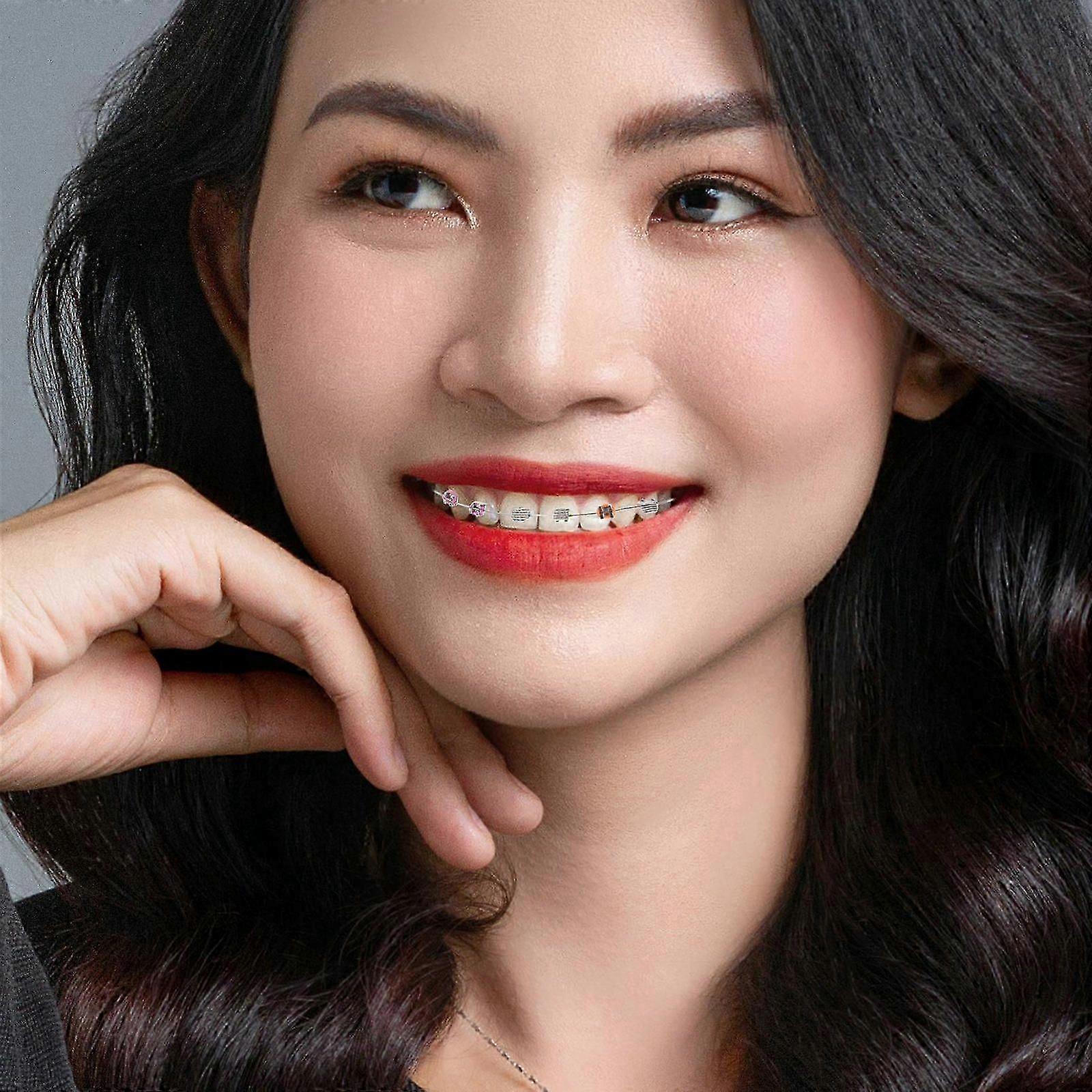 Dental Bracket Lingual Brace Brace Fake Brace Prop Brace Bracket Brace ...