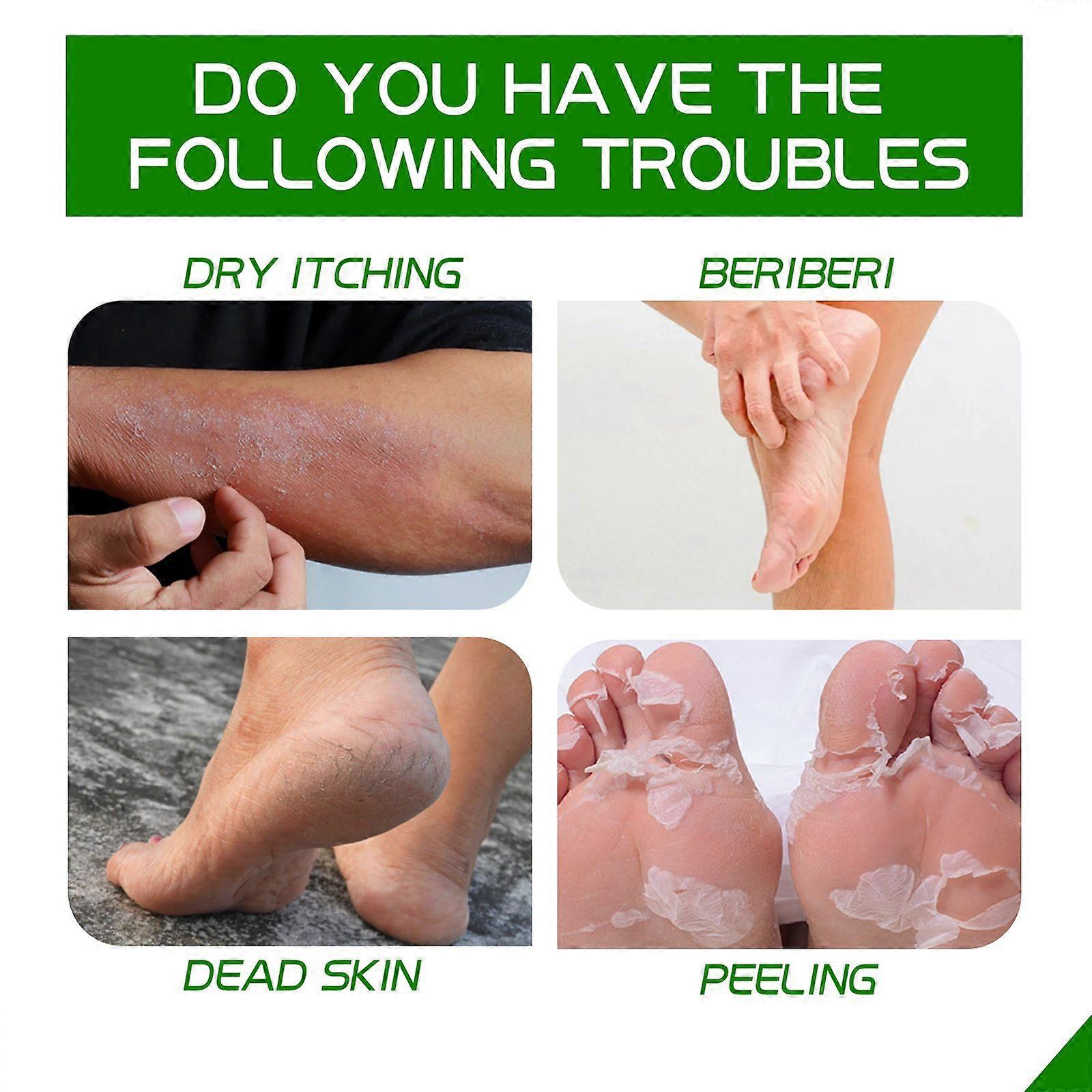 Foot Care Cream Moisturizing Foot Skin Anti-Cracking, Peeling And ...