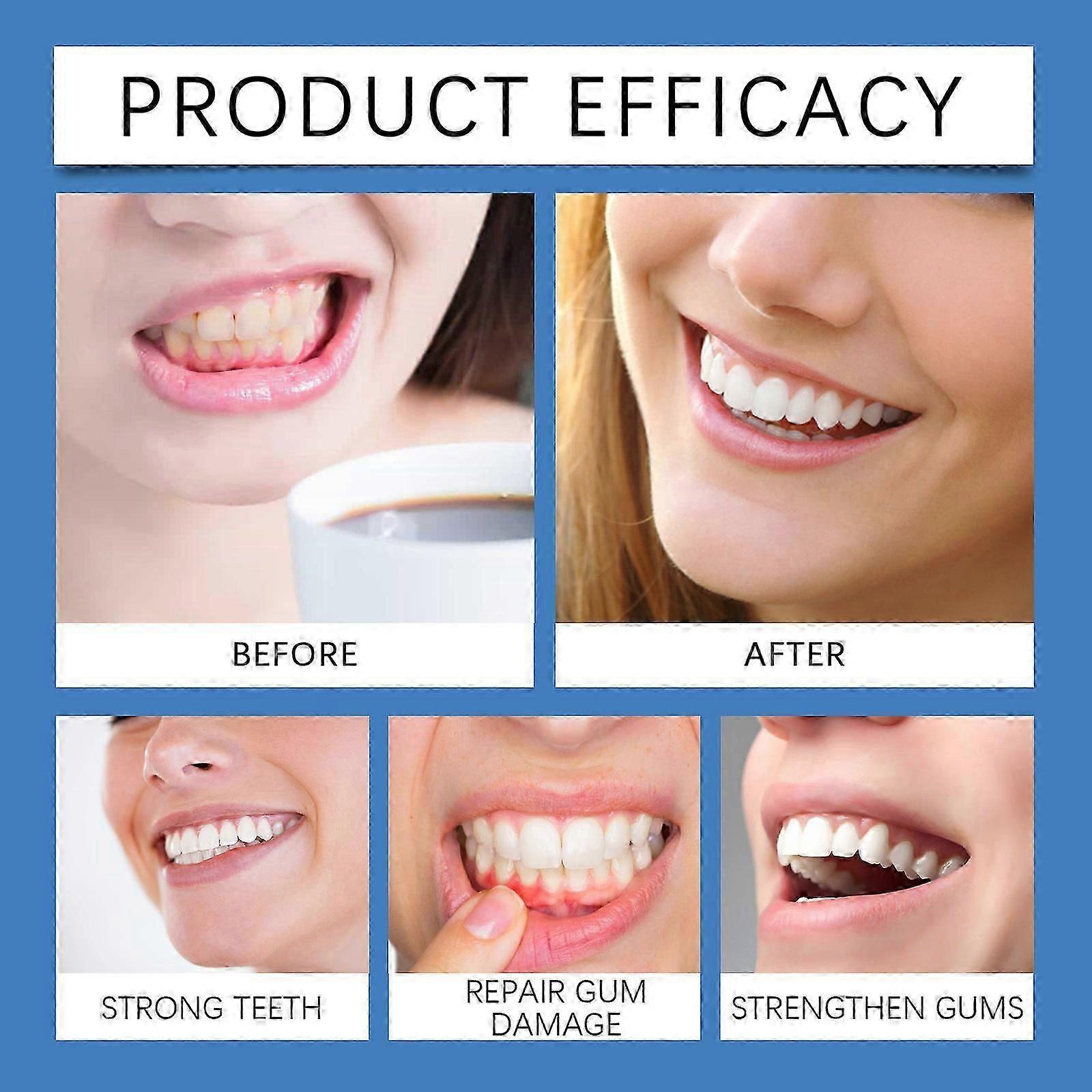 Pro-Health Advanced Mouthwash, Extra Whitening Mouthwash, Energizing ...