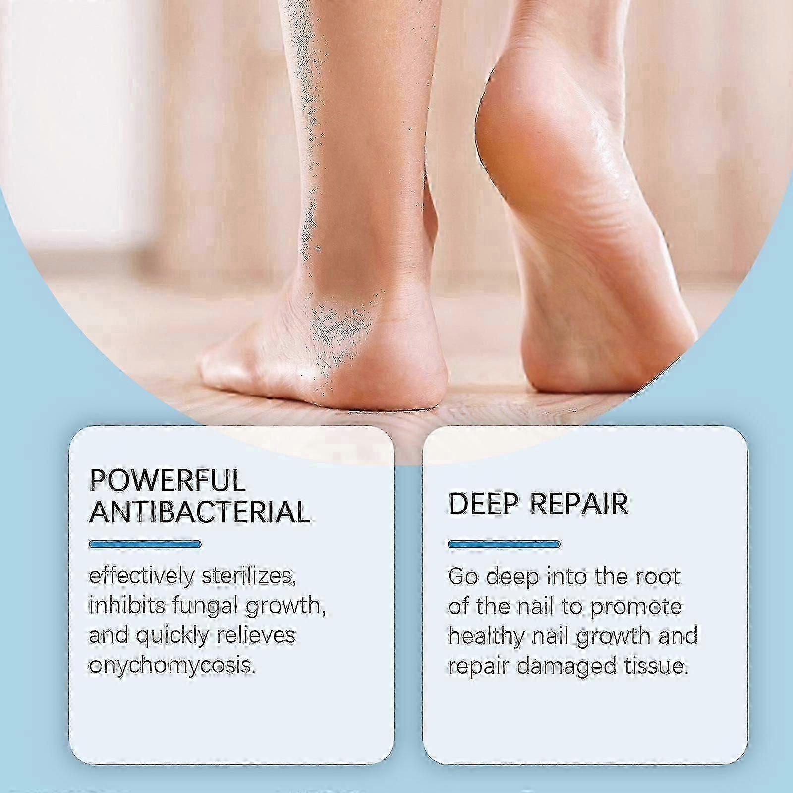 7 Days Nail Fungus Treatment, 30ml Comfrey Nail Growth and Strengthening Serum, Extra Strength ...