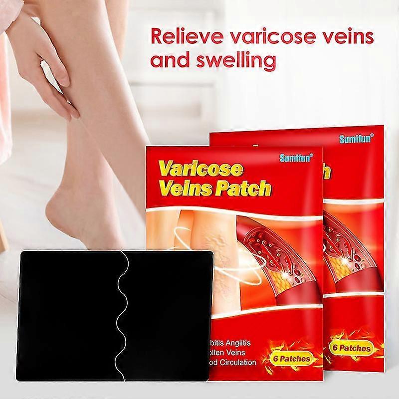 60/80pcs 2types Of Varicose Veins Patch Treat Thigh Phlebitis ...