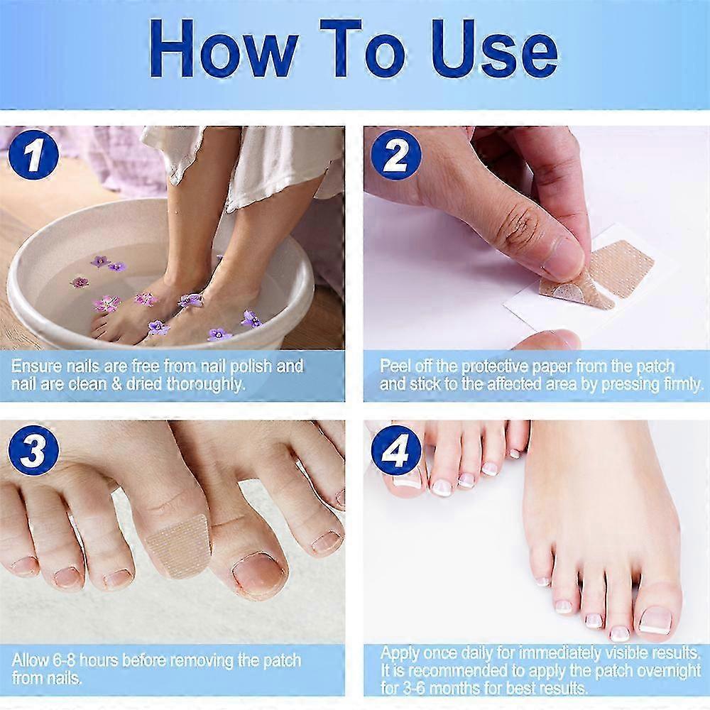 120Pcs Toenail Fungus Patch Breathable Nail Repair Patches Nail Repair ...