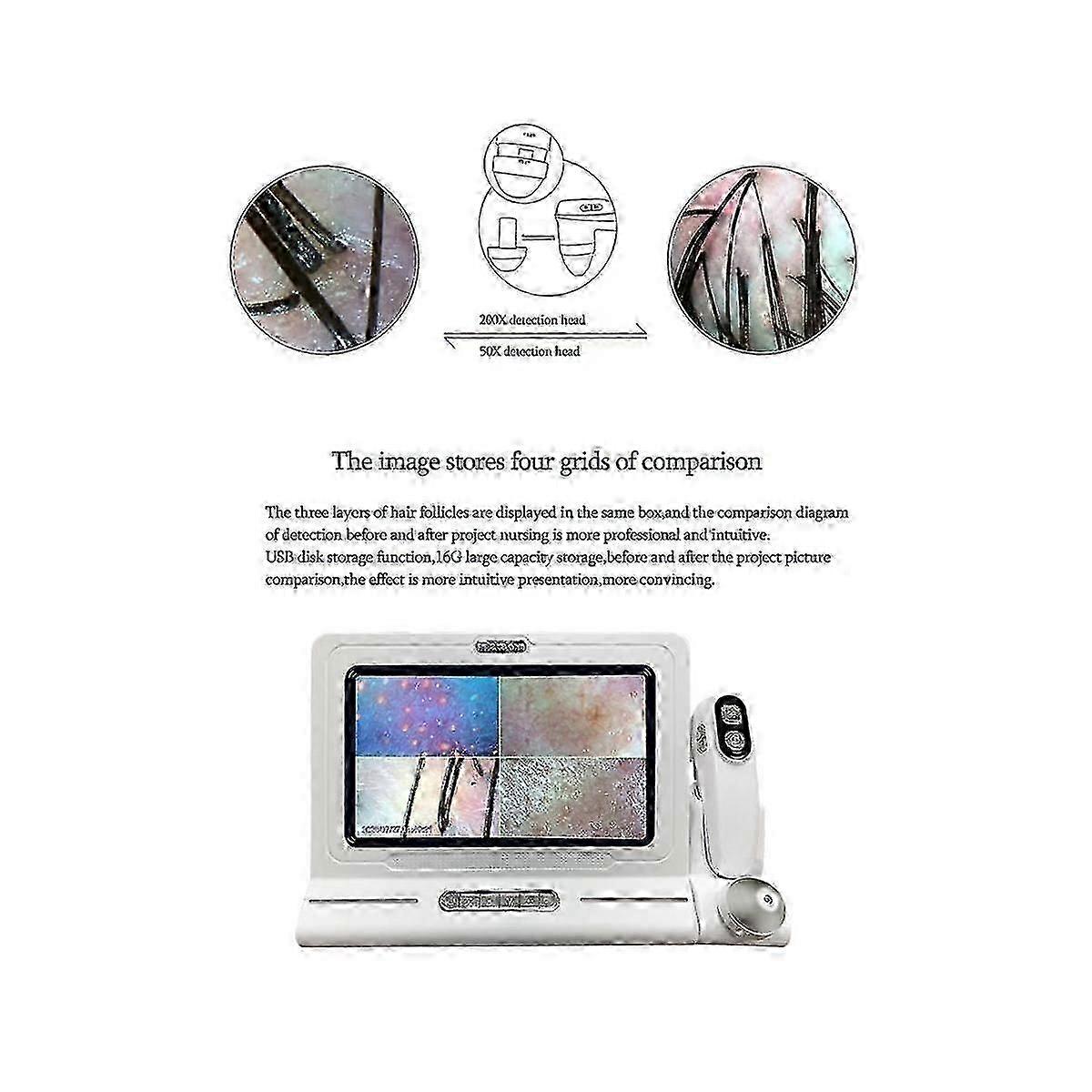 11 Inch LCD Skin Hair Scalp Analyzer Detector Digital Microscope ...
