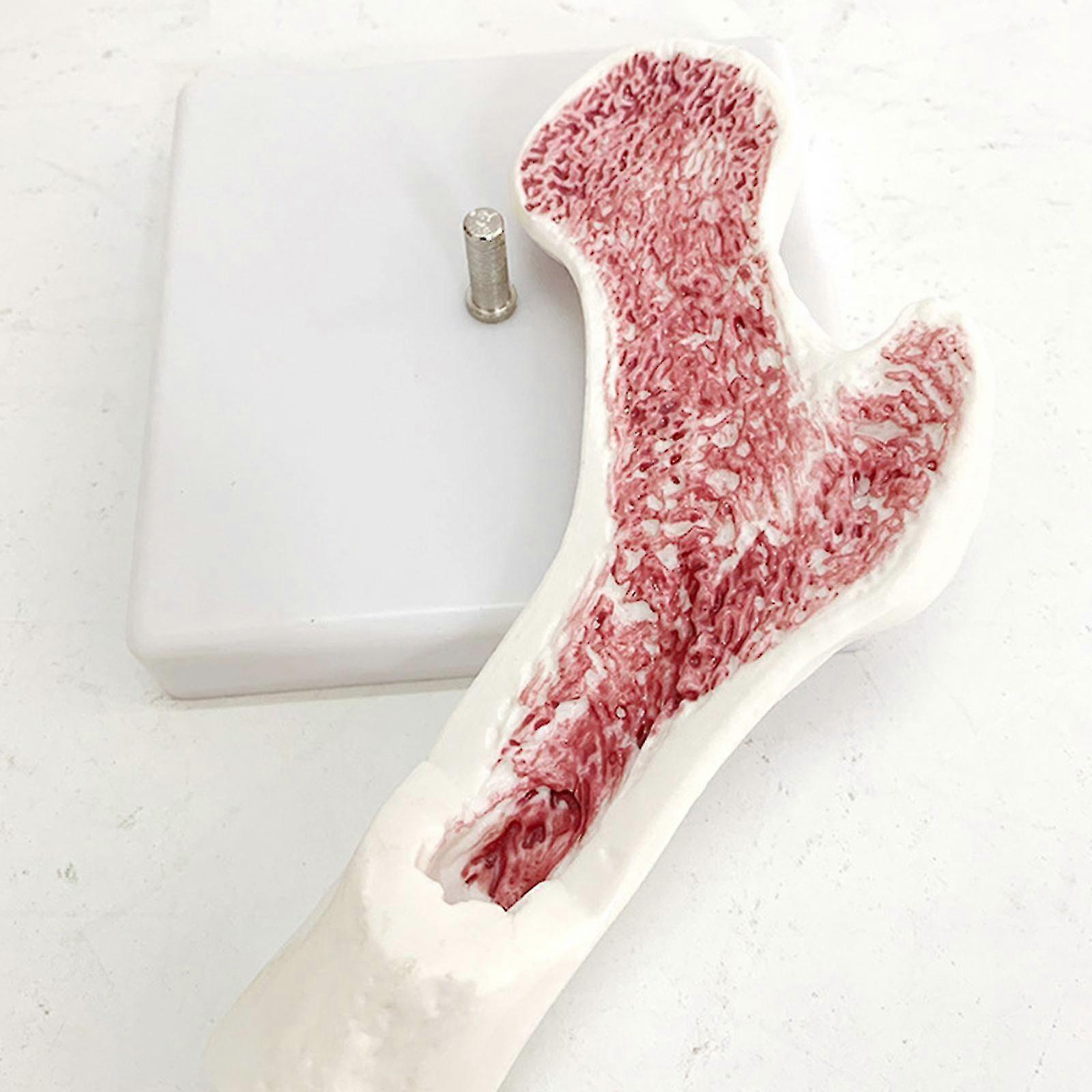 Femur Leg Bone Disease Model Pvc Anatomical Model For Anatomy Teaching ...