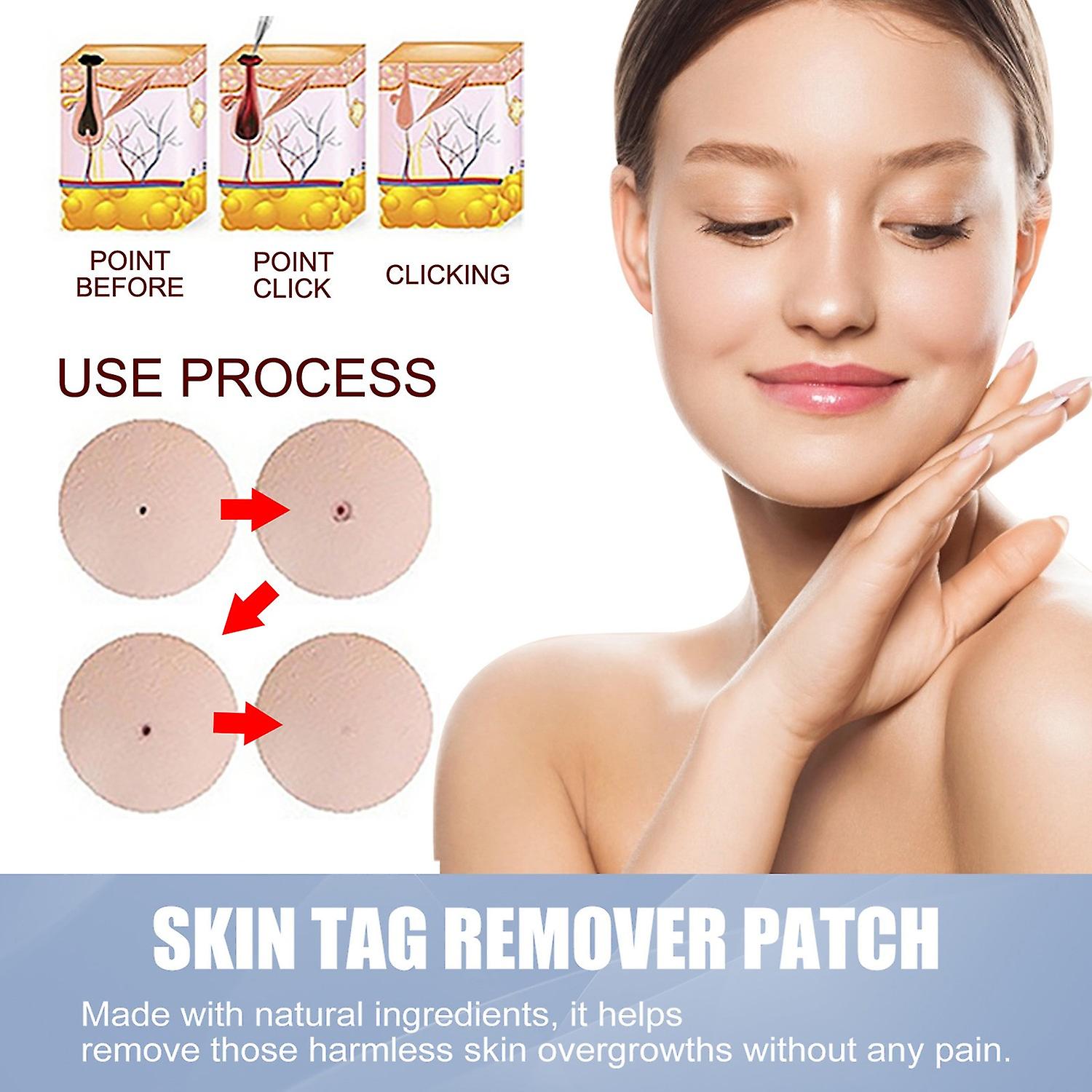 EELHOE Skin T-ag Remover Patches Mole Wart Removing Sticker Natural ...