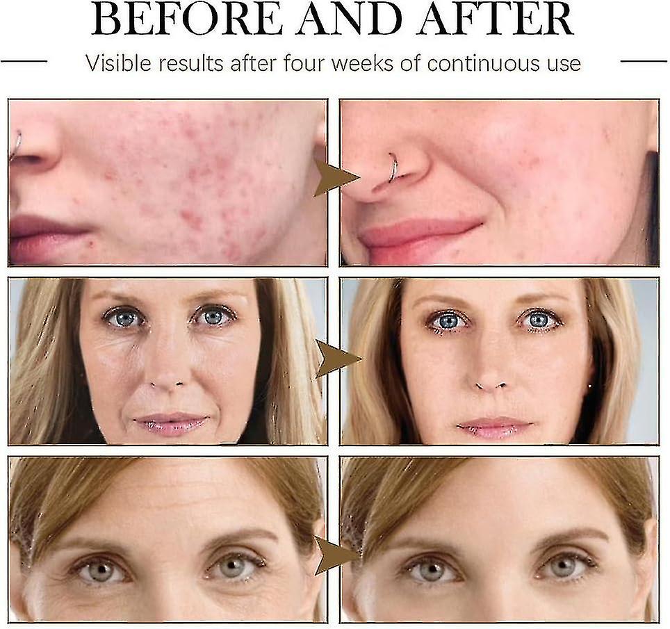 Castor Oil,castor Oil Black Seed Oil Rosehip Oil Face Serum,lalena Rosehip Oil Black Seed Oil ...