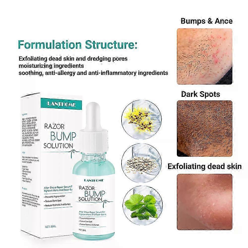 Razor Bump Plug After Shave Hair Growth Treatment Reduces Dark Spots ...