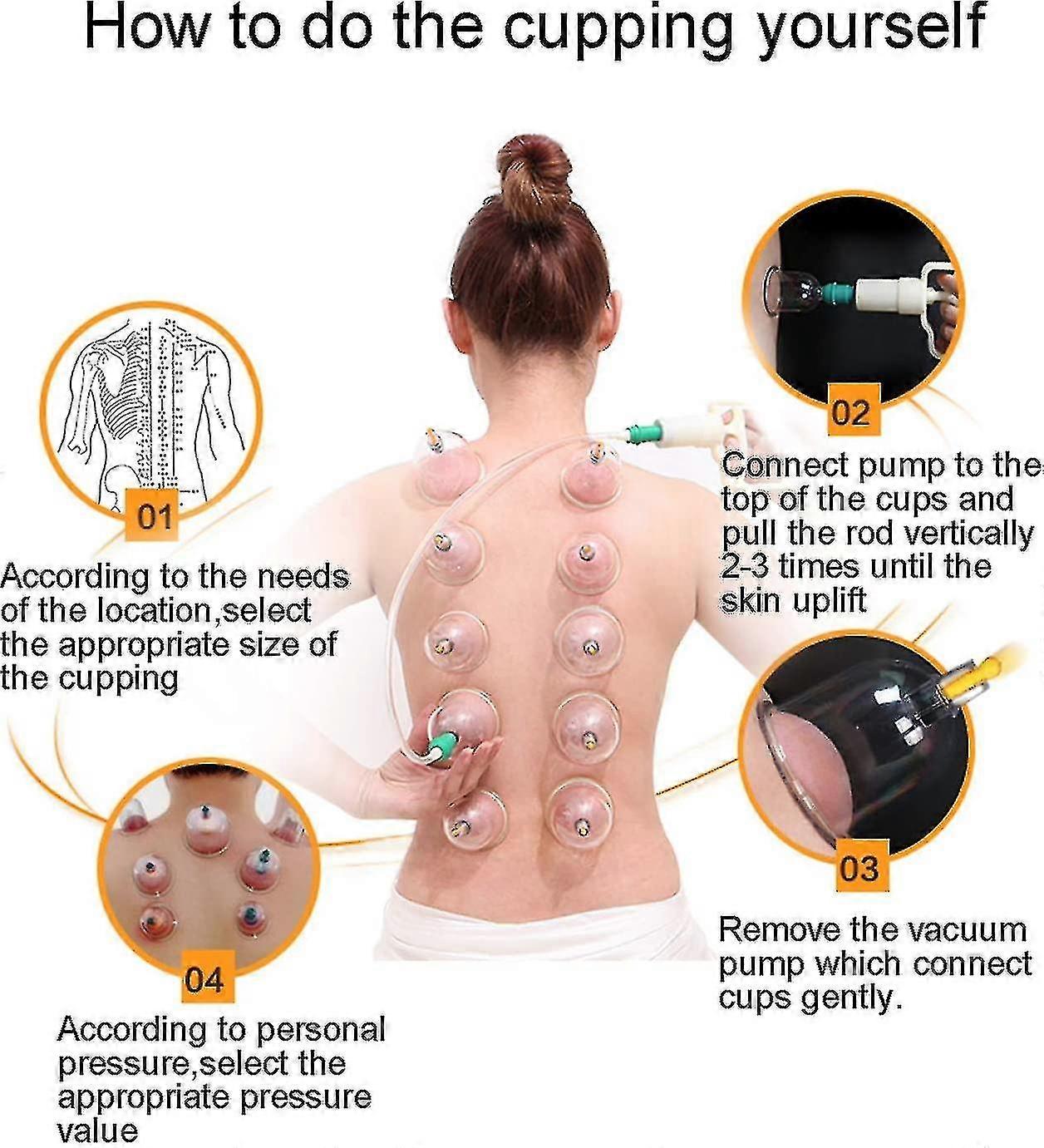 Cupping Therapy Sets,24 Cups Cupping Set With Pump Vacuum Suction Cups ...