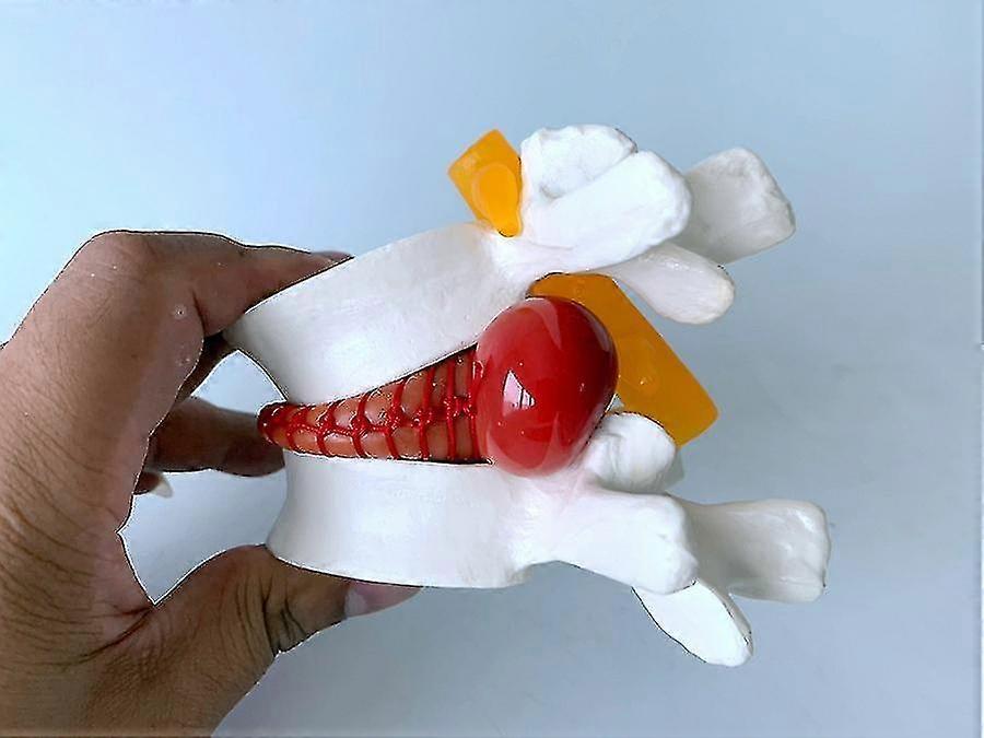 human Spine Model Vertebrae Lumbar Intervertebral Disc Model Vertebral ...