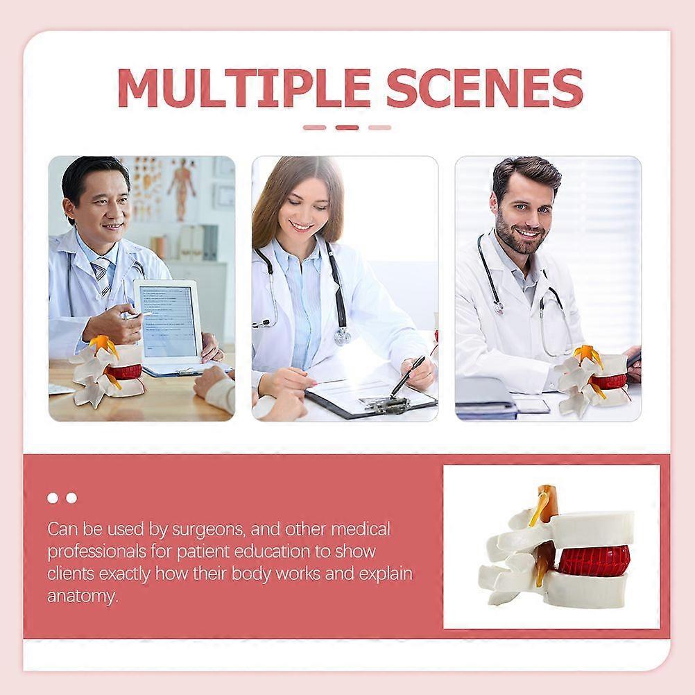 Human Lumbar Disc Herniation Model Lumbar Vertebrae Degenerative Model ...