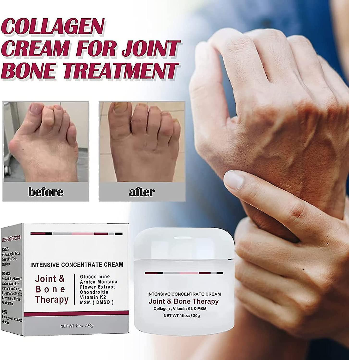 Joint & Muscle Therapy, Joint & Bone Cream, Joint Cream Intensive ...