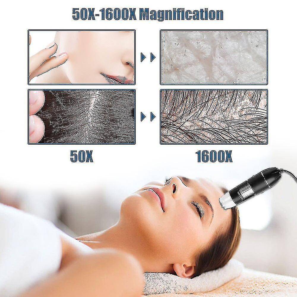 1600x Dermatoscope Skin Analyzer Machine Usb Scalp Diagnostic Machine ...