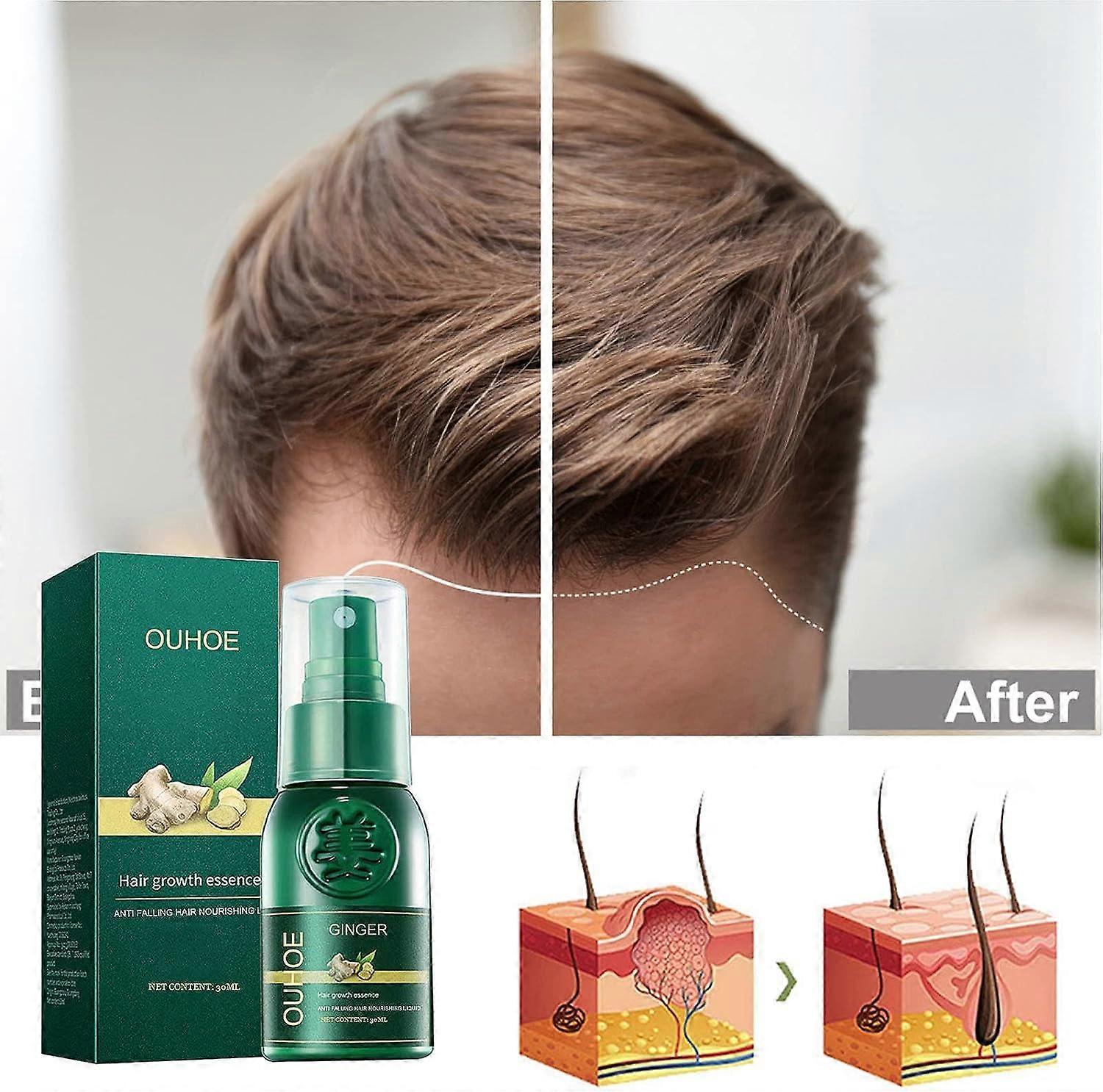 Ginger Hair Growth Spray, 30ML Hair Oil Mist, Nourishing Ginger Spray ...