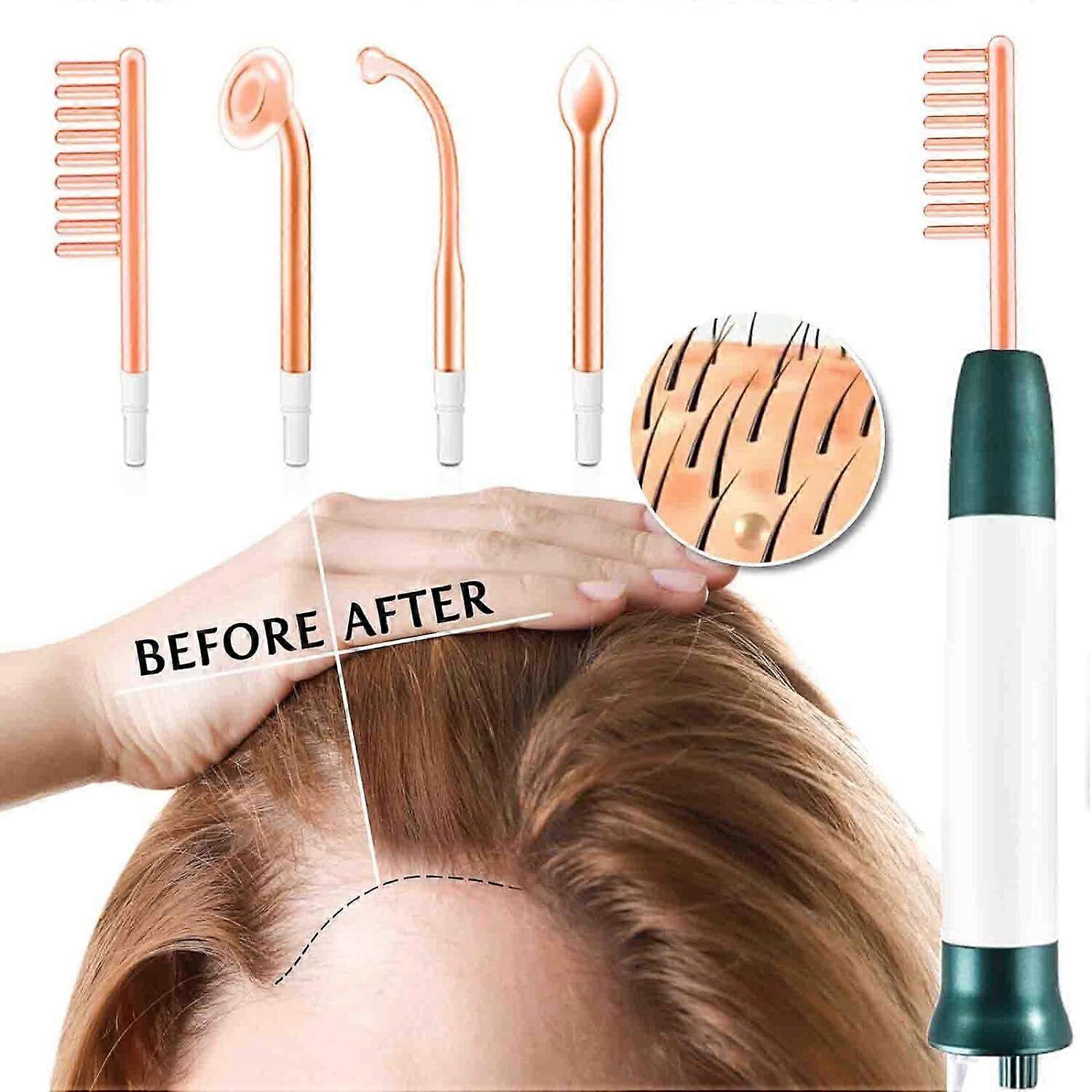 Comb Bundle, Hair Comb Hair Rejuvenator Brush EU Plug, High Frequency ...