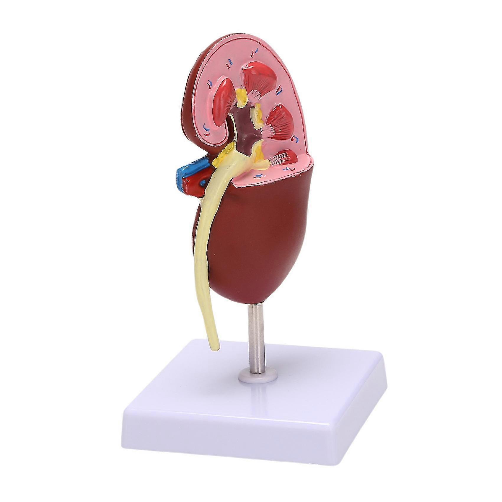 Kidney Pathologies Model Human Body Anatomy Replica Of Diseased Kidney ...