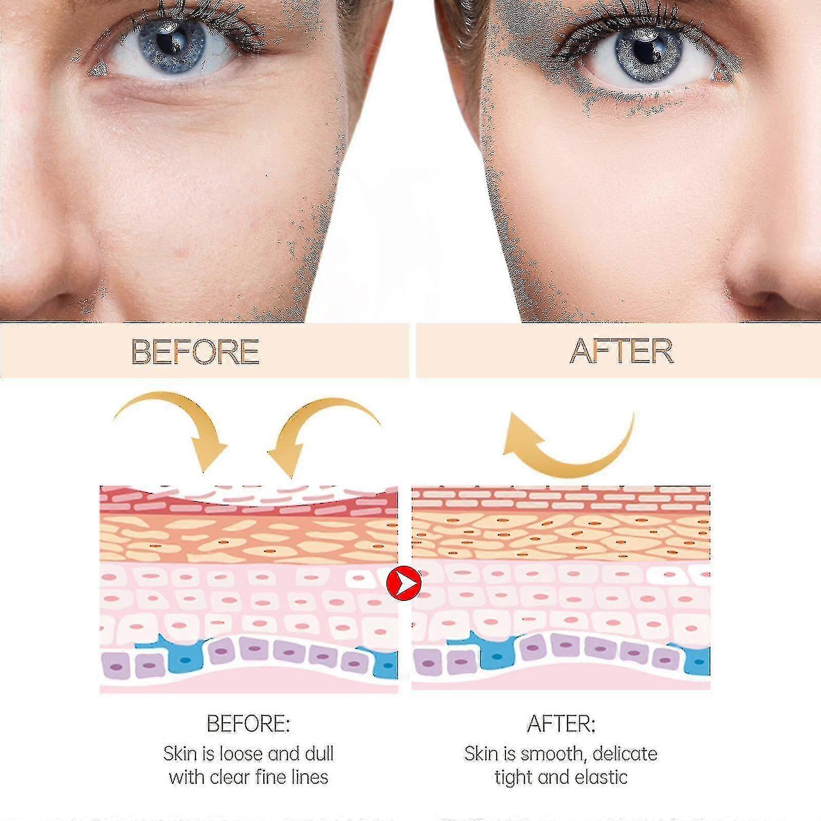 Ouhoe Anti-wrinkle Cream Stick Anti-wrinkle Hydrating Skin Fades Lines ...