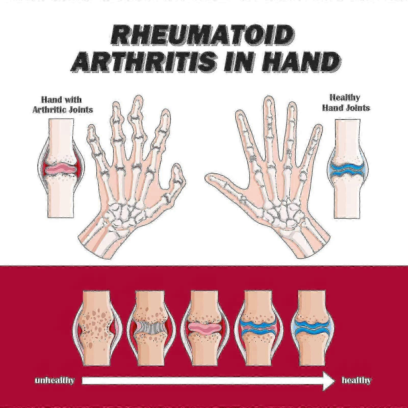 Joint&bone Therapy Cream,30g Natural Joint&bone Therapy Cream, Joint ...