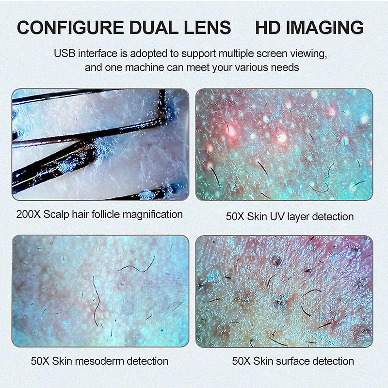 Professional Skin Hair Detector Scalp Hair Follicle Moisture/skin Pores ...