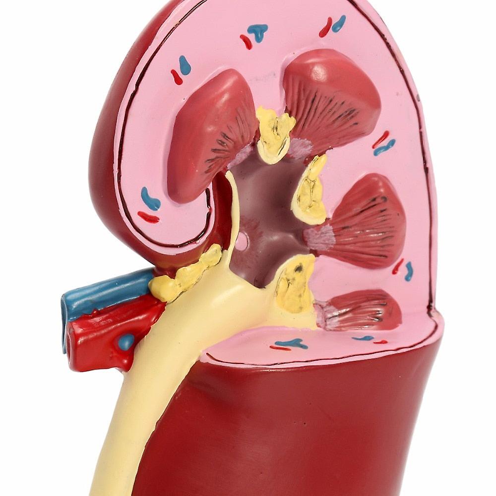 Kidney Pathologies Model Human Body Anatomy Replica Of Diseased Kidney ...