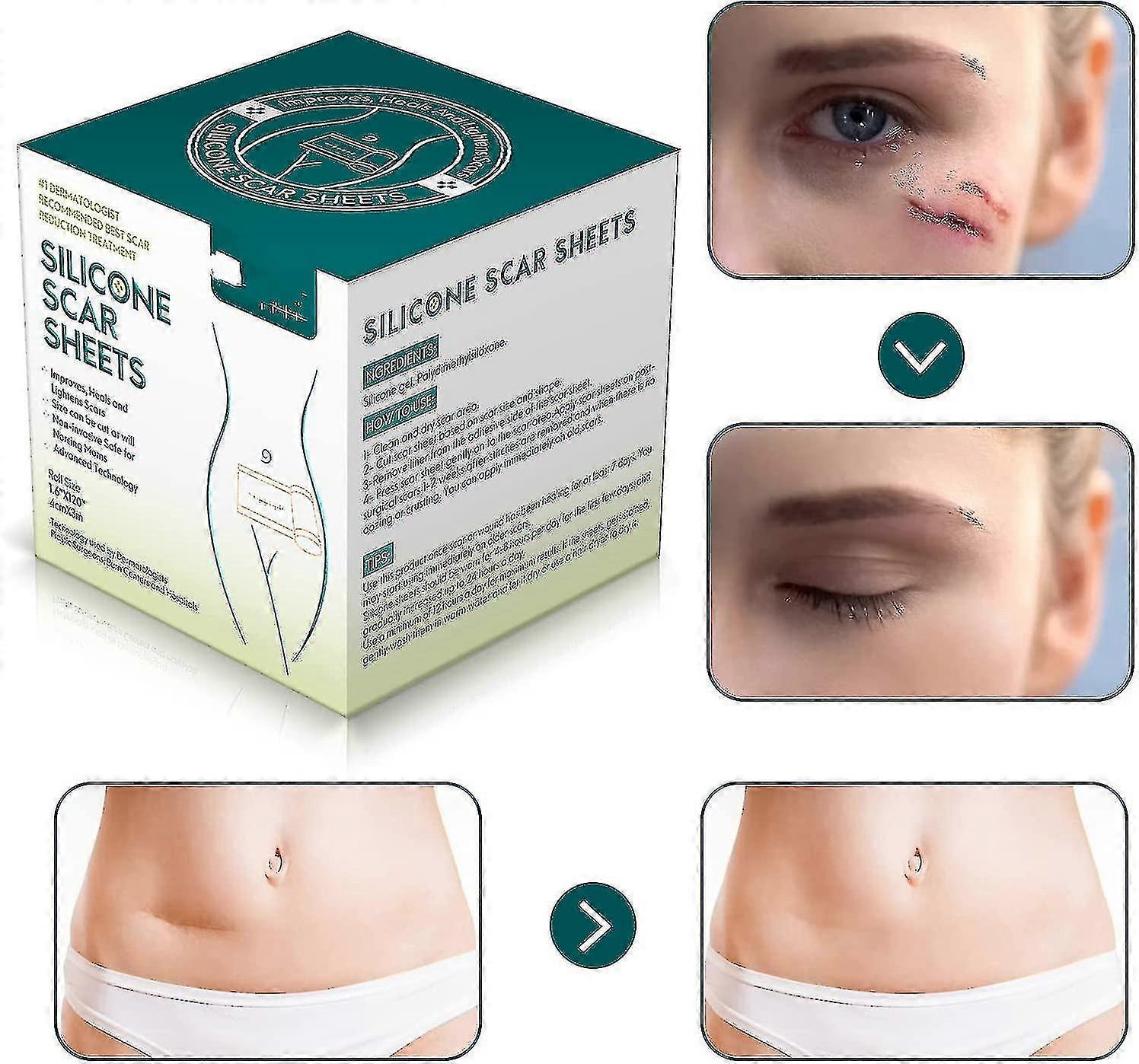 Silicone Scar Sheets Medical Grade Silicone Scar Gel Tape, Soft ...