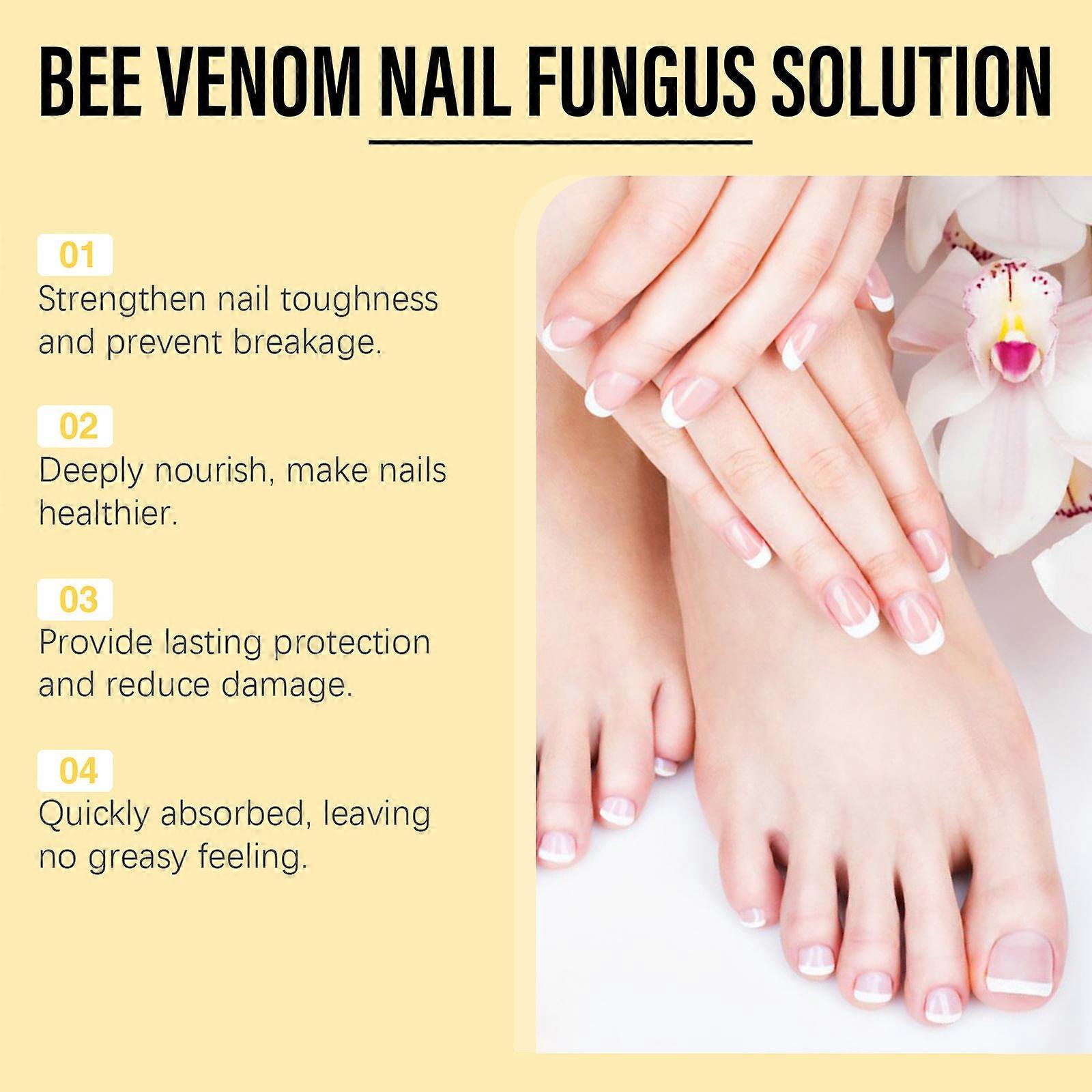 Bee Venom Toenail Fungus Treatment,Tånagelsvamp Behandling Extra Styrka ...