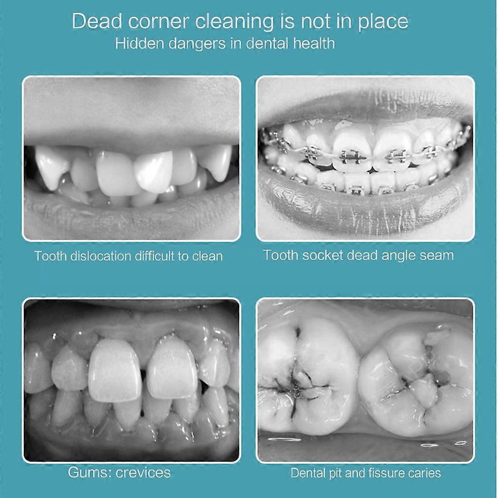 Interdental Brush Dental Braces Clean Between Teeth Toothpicks Soft ...