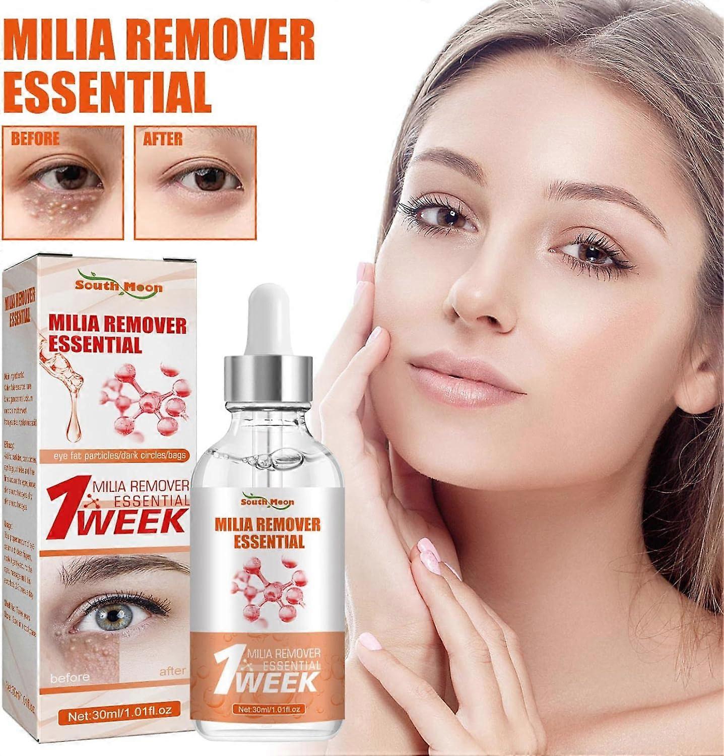 1PC Speedy Milia Remover, Milia Remover Milia Spot Treatment, Speedy ...