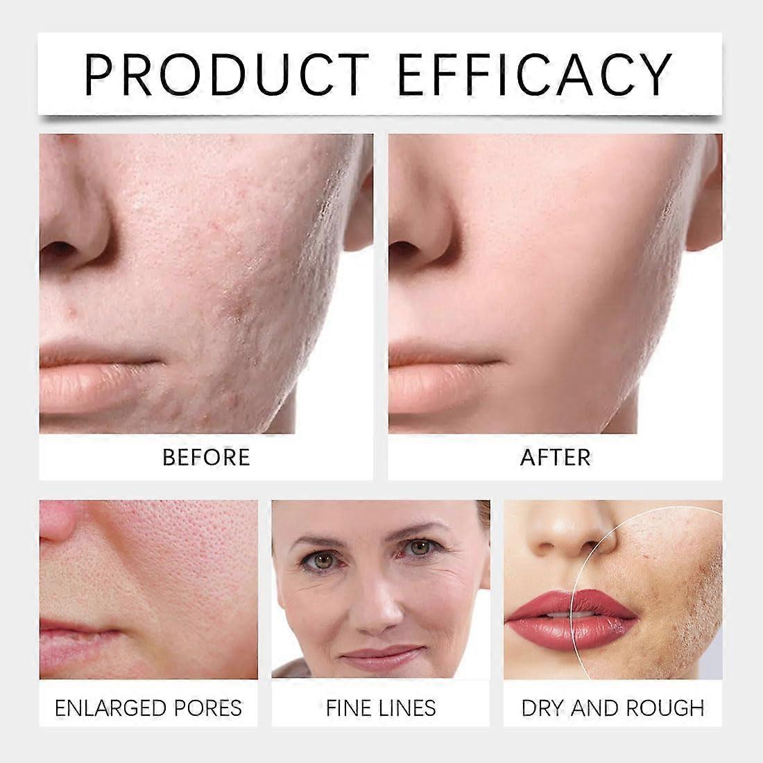 SS Collagen Reverse Volume Peel Off Face Mask Pack, Collagen Face Mask ...