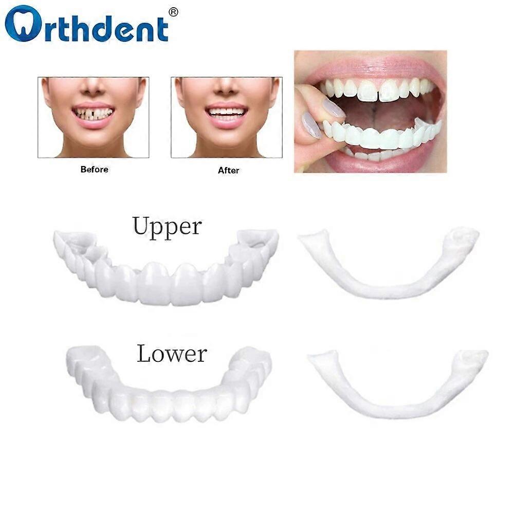 Temporary Tooth Repair Kit Denture Adhesive Upper & Lower Teeth Veneers ...