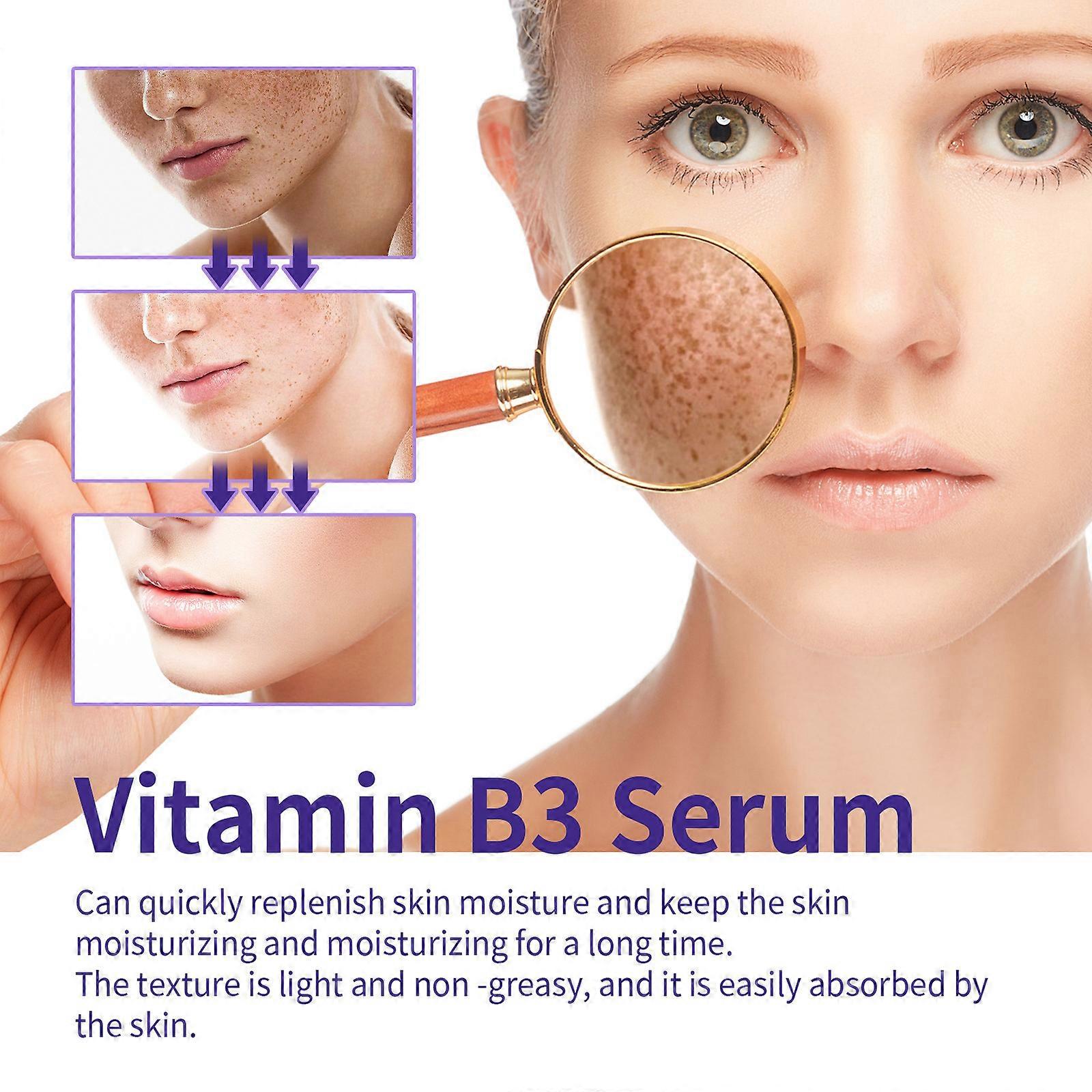 B3 Serum, Dark Spot Corrector With Anti-Aging Melasyl + 10% Niacinamide ...