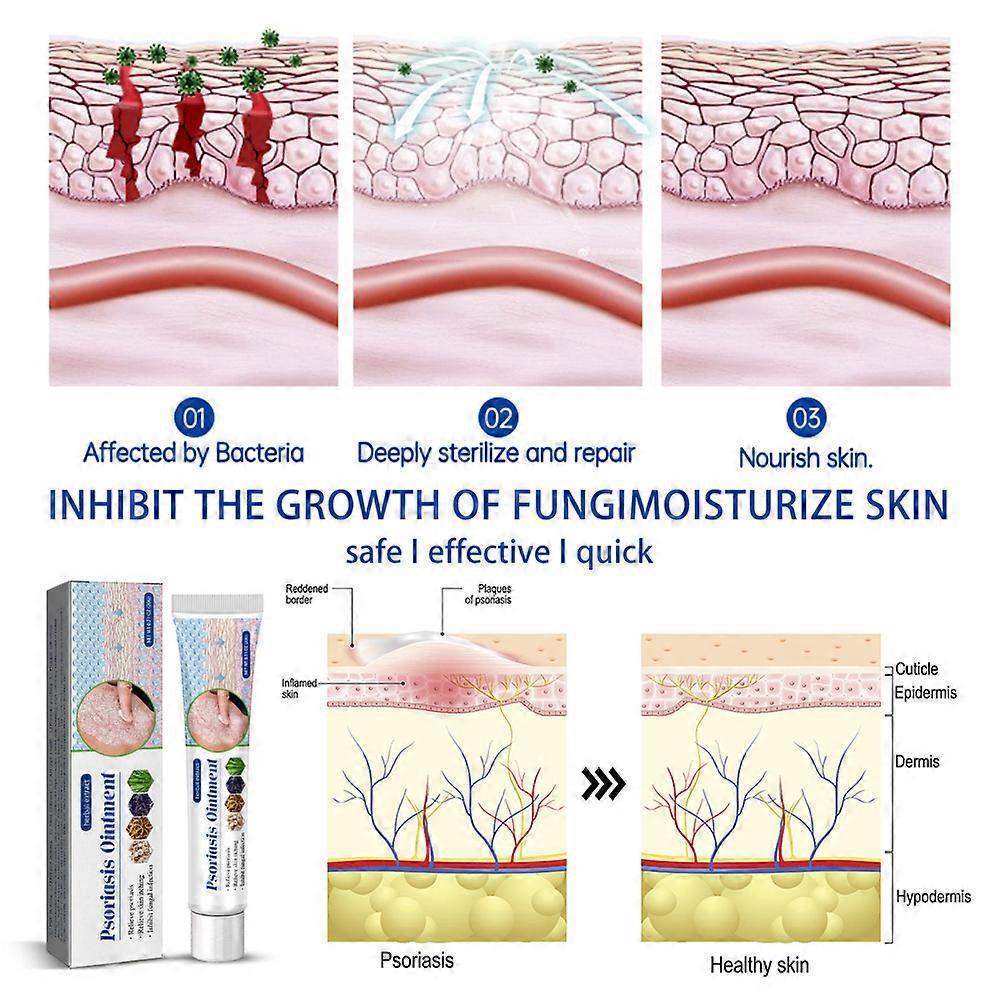 Itching Cream Antibacterial Pruritus Anti-itch Skin Care 20g | Fruugo SE