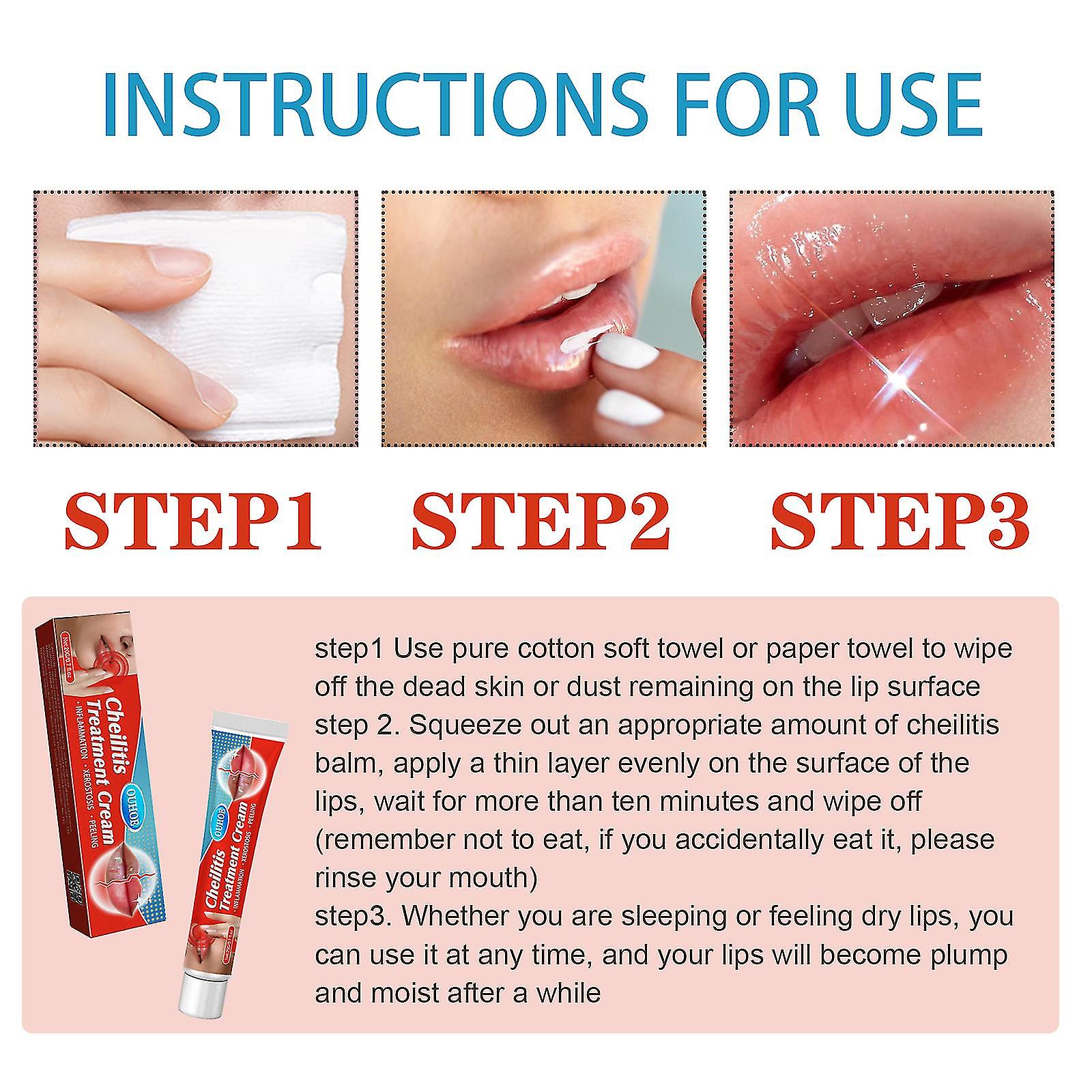 20g Lip Balm Cheilitis Treatment Cream Remove Dark Oil Moisturizing ...