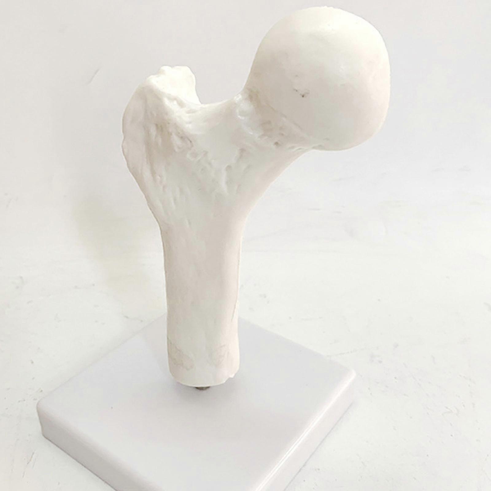 Femur Leg Bone Disease Model Pvc Anatomical Model For Anatomy Teaching ...