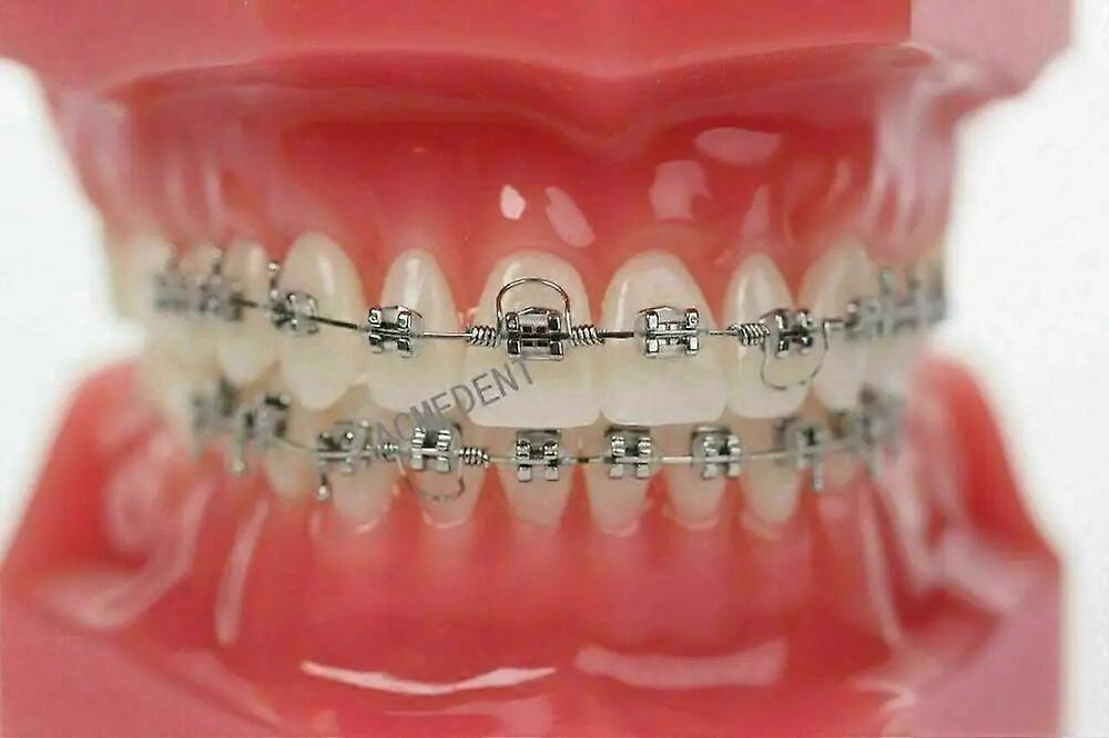 50 Pieces Goodman Dental Orthodontic Torquing Torque Rectangular Spring ...