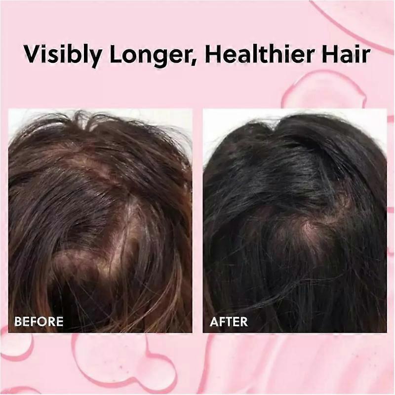 Advanced Hair Growth Oil Spray -Non-Greasy Hormone Free Formula ...