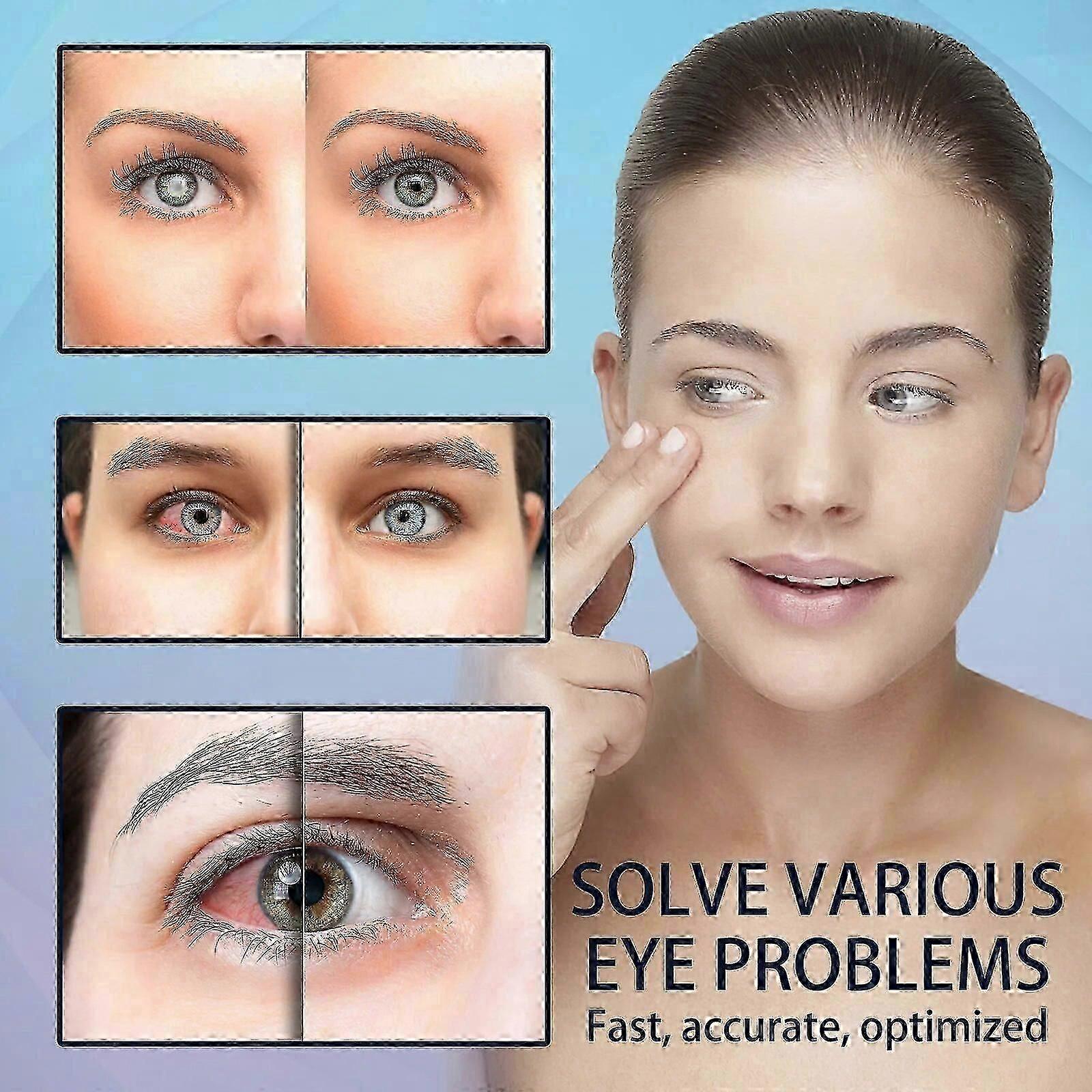 Red Eyes Drops Moisturizing Antibacterial Relief Discomfort ...