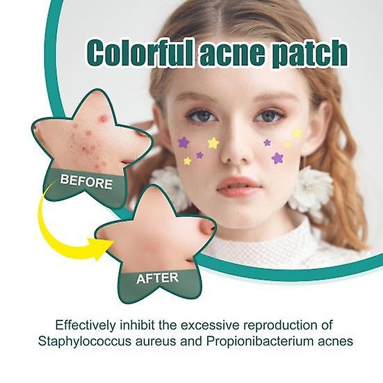 112Pcs/Bag Star-shaped Acne Stickers Fast Relief Repair Effective ...