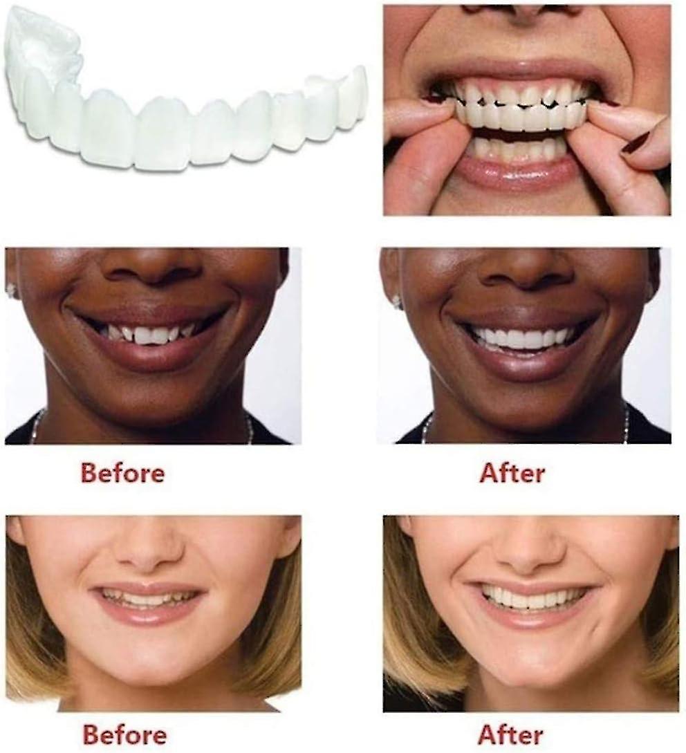 A Pair Upper & Lower High Quality Denture Instant Smile Comfort Fit ...