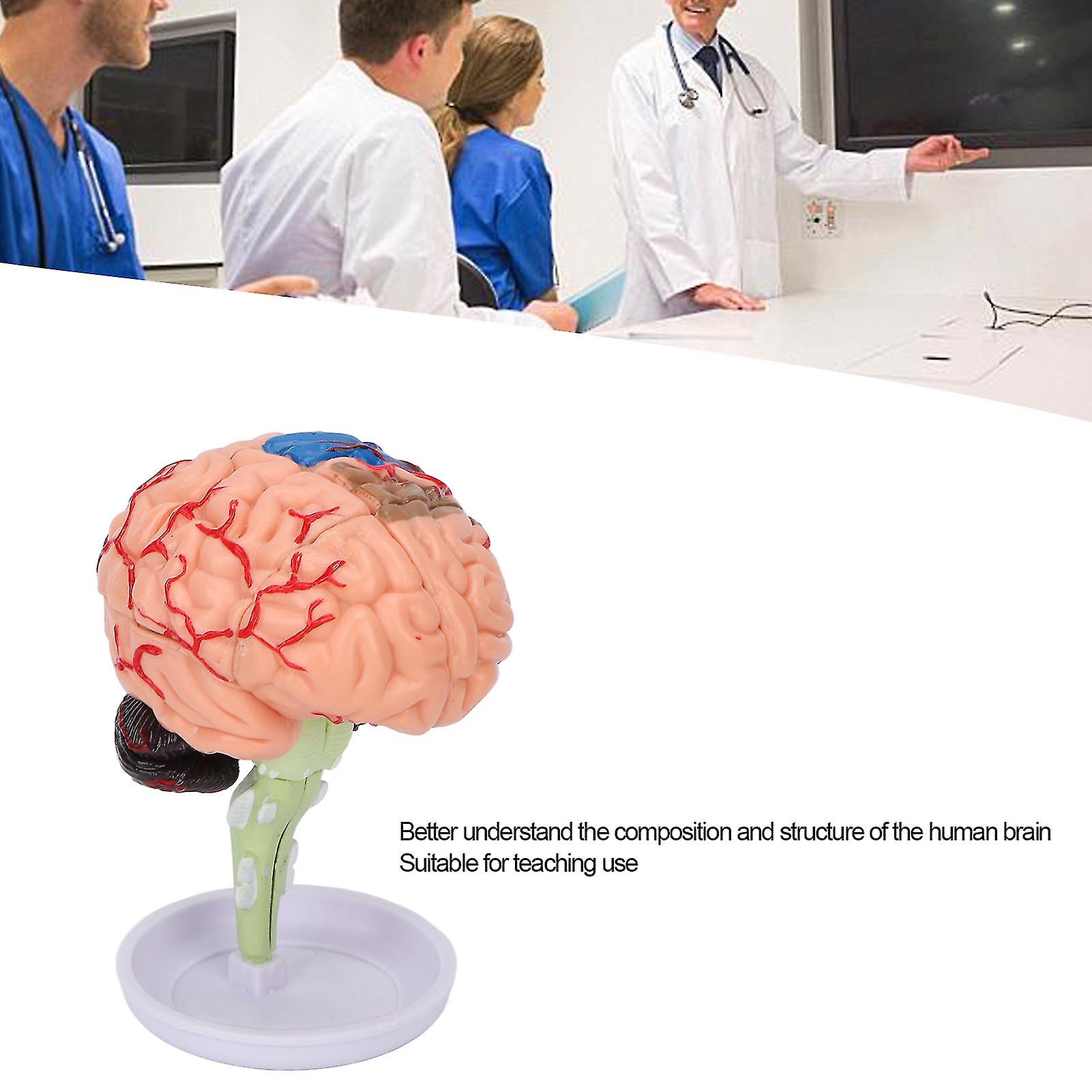 2024 New,4d Anatomical Brain Assembled Model Clear Structure Vinyl ...