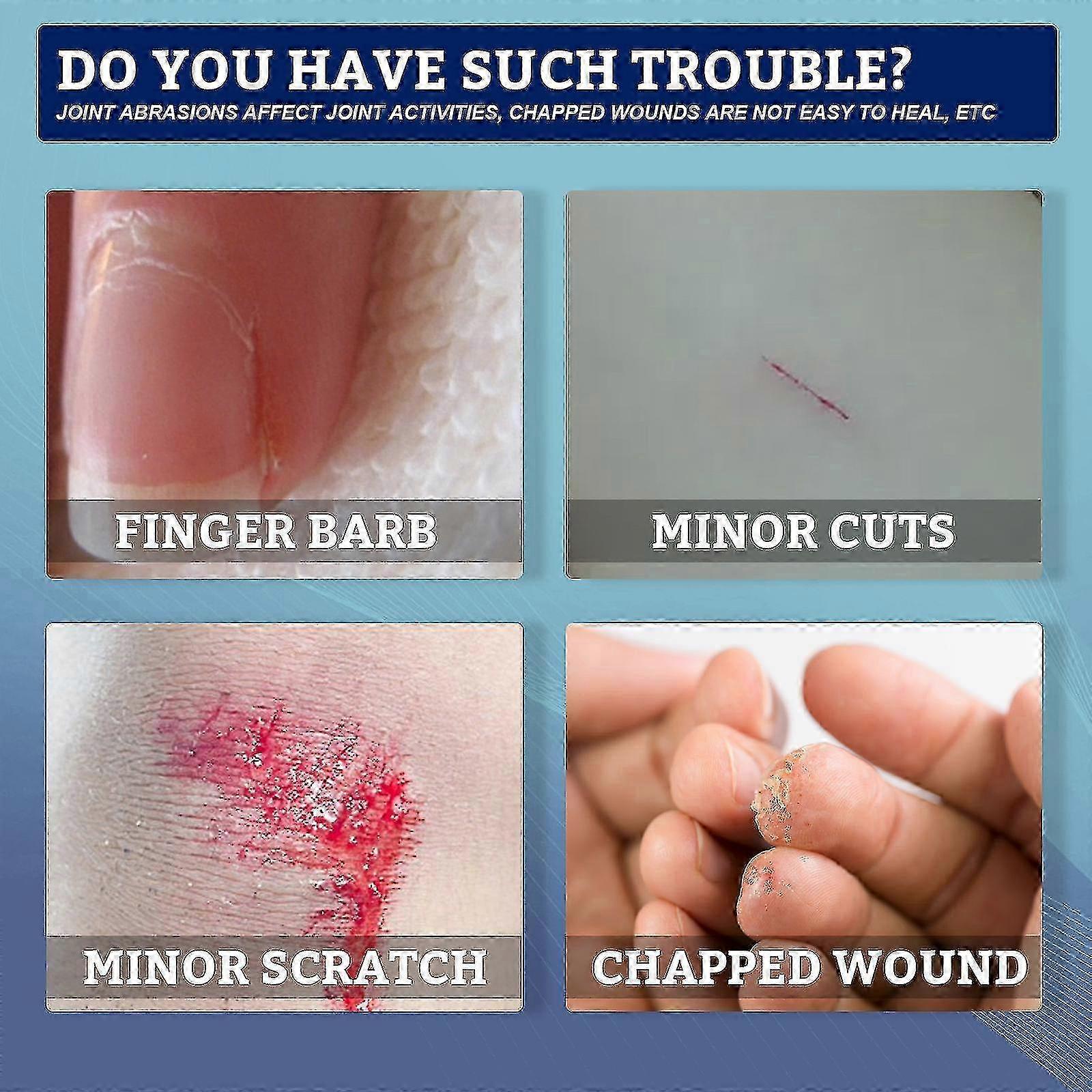 Of Liquid Band-aid Liquid Dressing Transparent Wound Dressing Wound ...