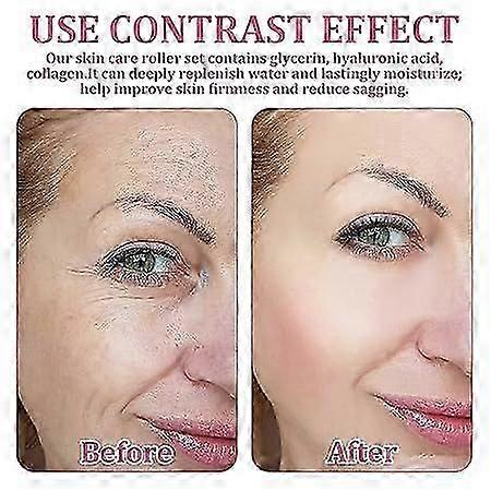 Micro Infusion System, Lip Fix Micro Infusion, Micro Infusion System ...