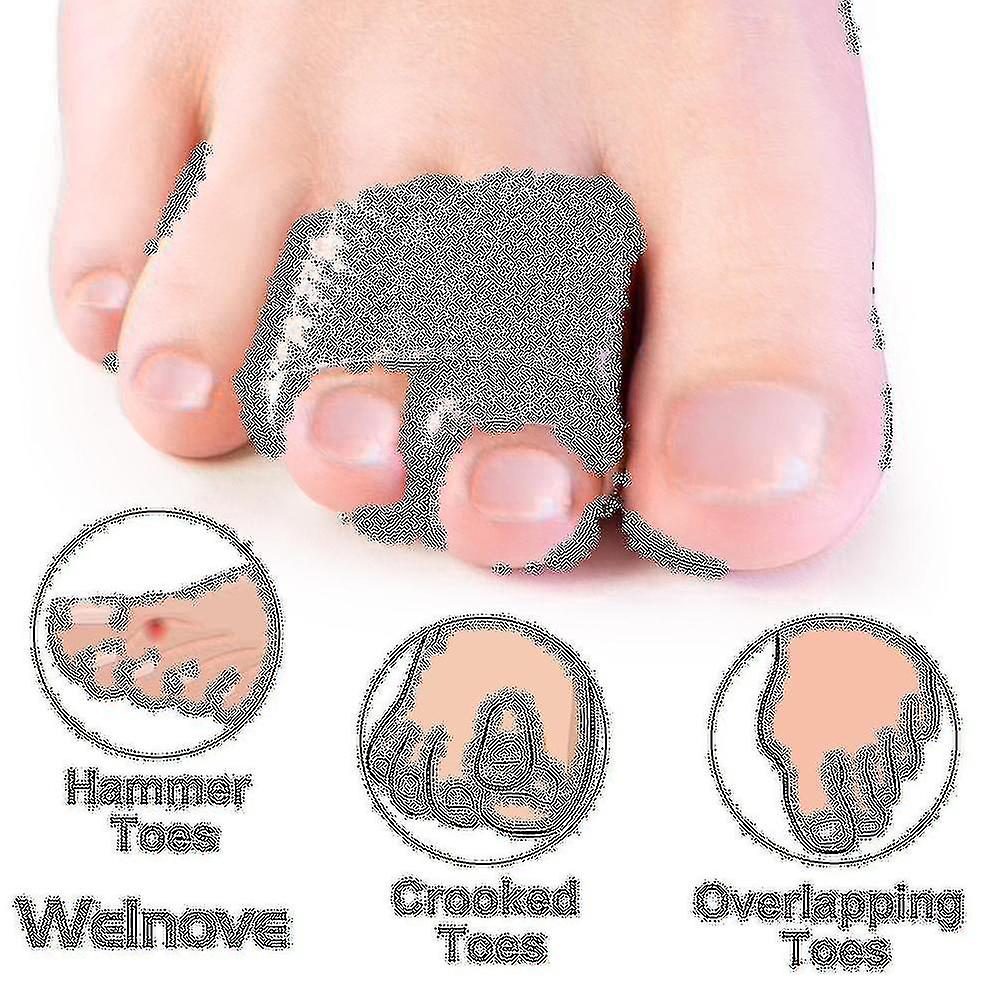 10 Toe Bandages, Broken Toe Splints, Padding To Correct Hammer Toes ...