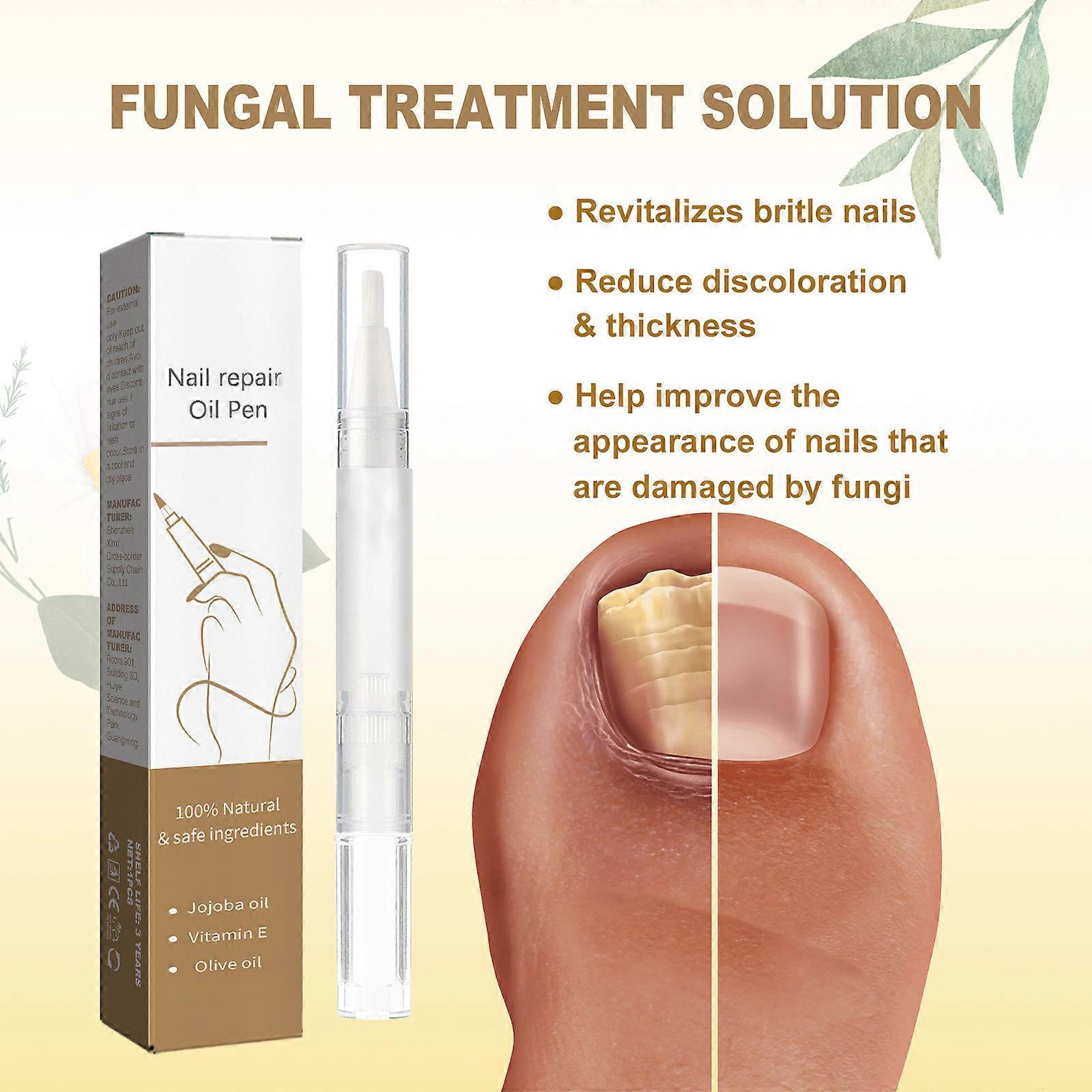 Toenail Renewal Solution Extra Strength Care for Toe Nail & Fingernails ...