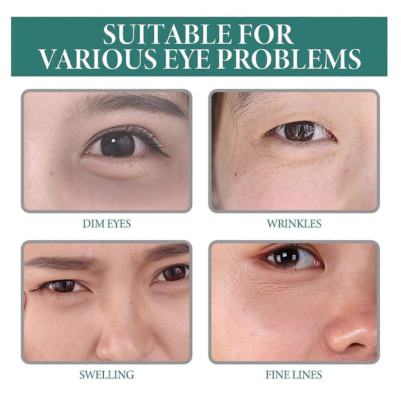 Puffy Eye Serum, Repair Essence Refreshing Hydrating Firming Brightens ...