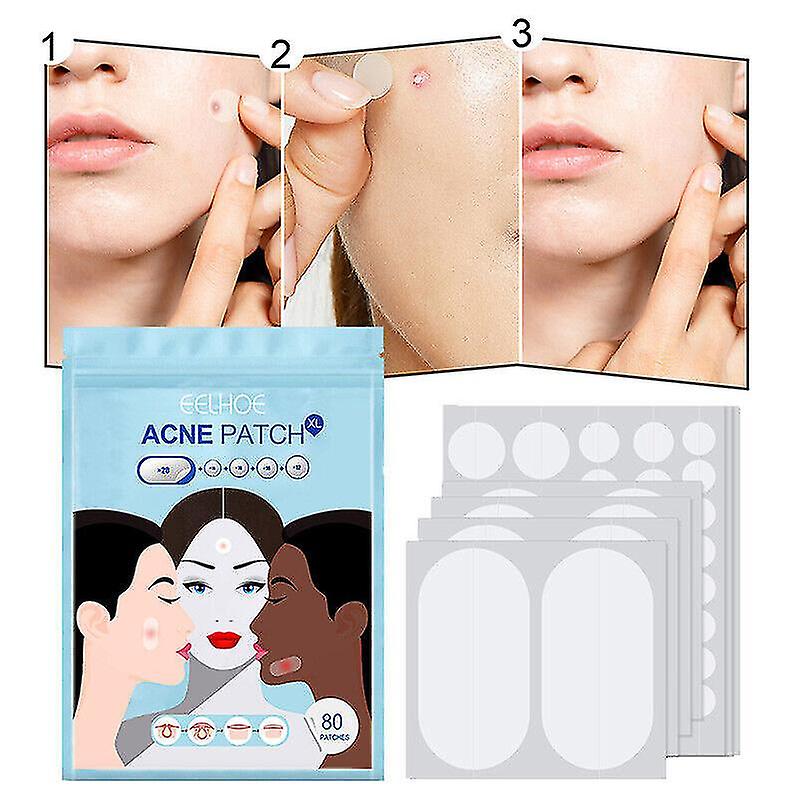 160cs Large Acne Patch Pimple Hydrocolloid Stickers Spot Cover Remover ...