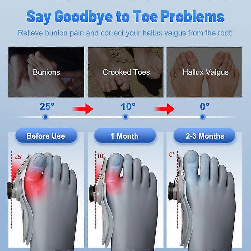 Bunion Corrector Foot Posture Corrector Foot Relief Hallux Valgus Toe ...