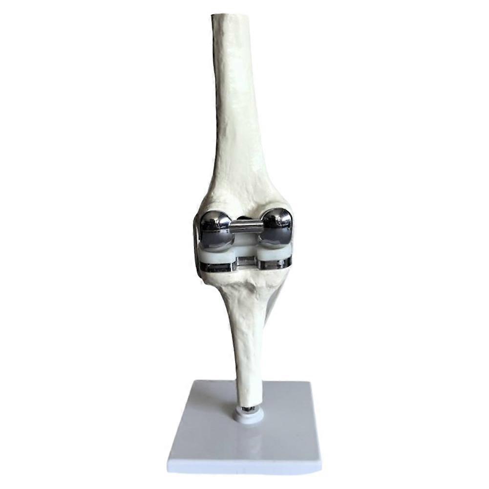 Knee Joint Model Simulation Replacement Surgery Meniscus Ligament ...