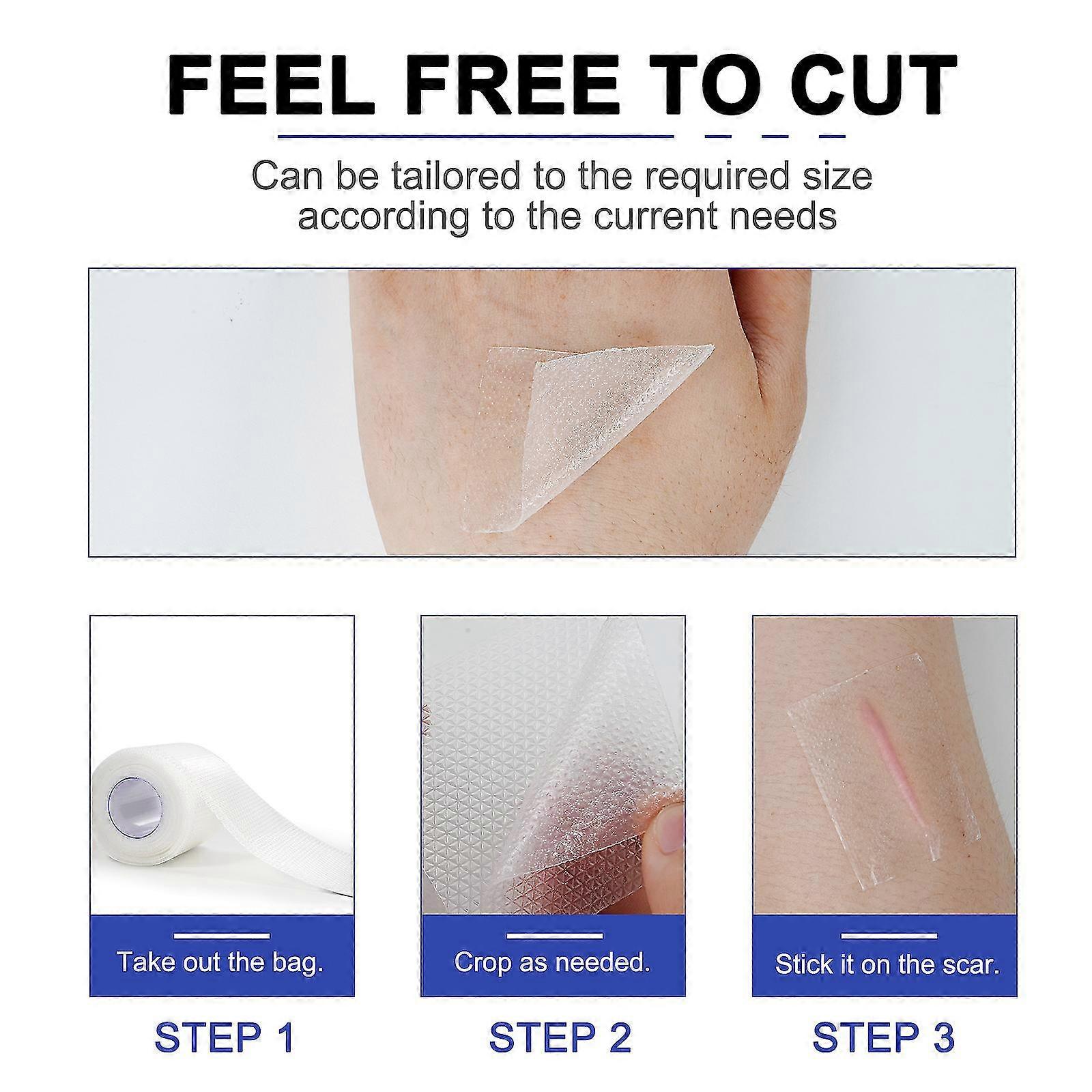 Silicone Scar Sheets, Clear Scar Tape, Silicone Scar Strips, Effective ...