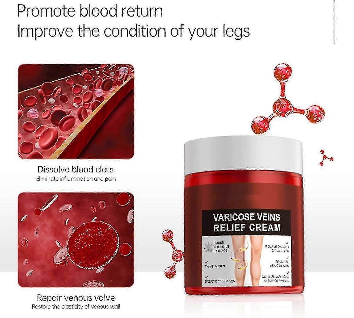 1-3x Spatader Relief Cream, Natuurlijke Anti-Spatader Crème, Anti ...