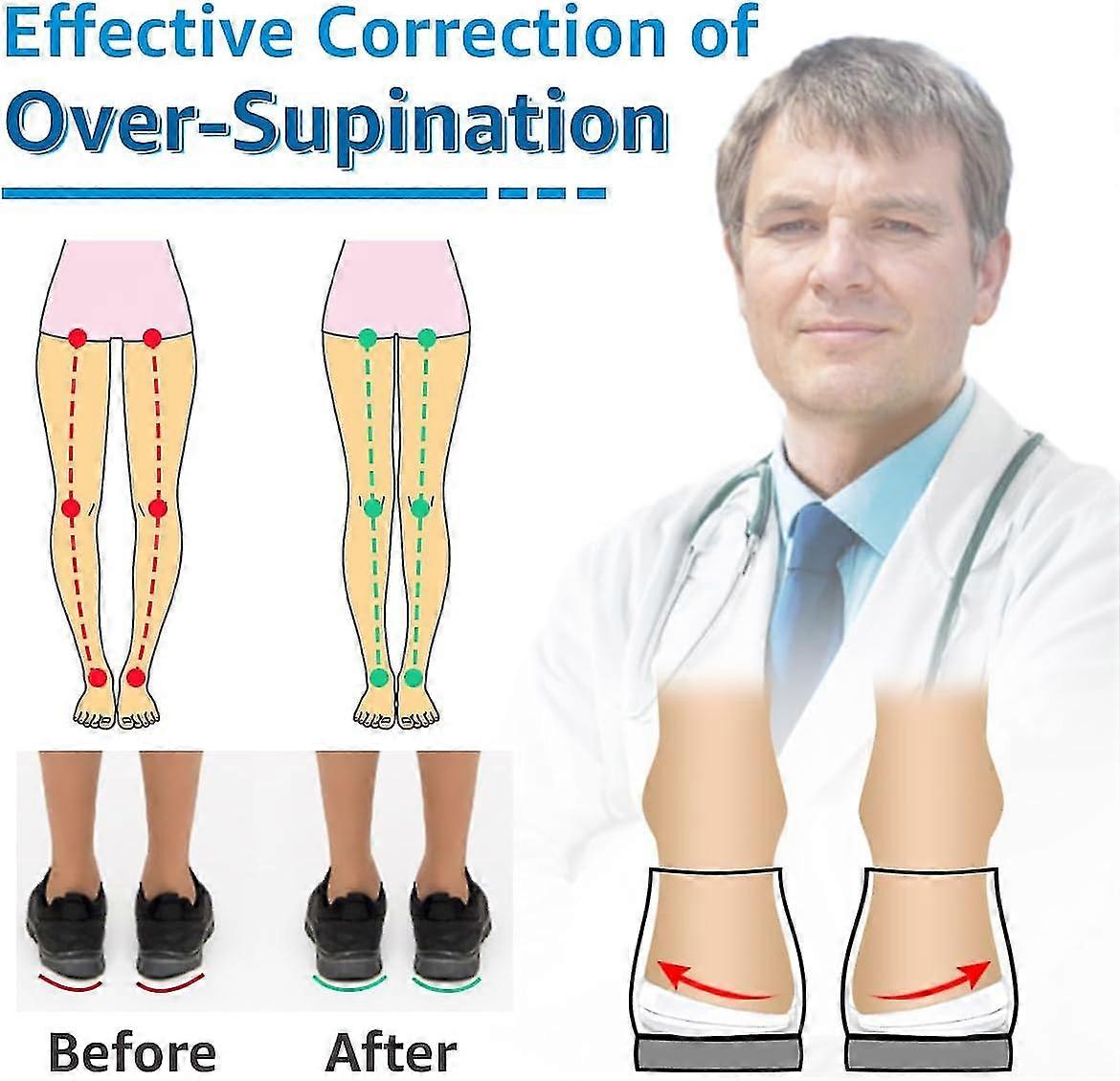 2/3 Layer Adjustable Orthopedic Heel Lift for Supination & Over ...